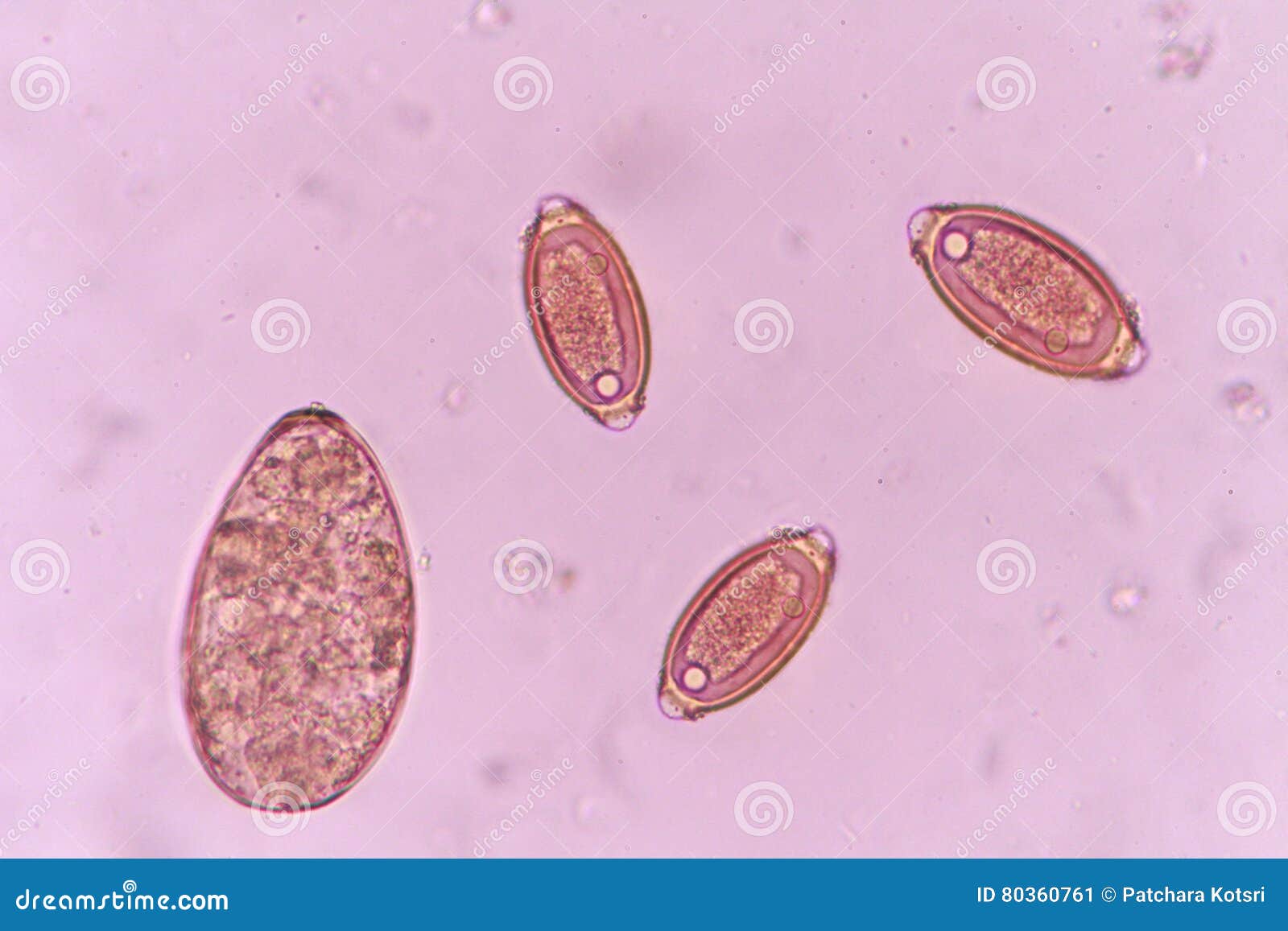 Paragonimus stock image. Image of zoology, fluke, lung - 80360761