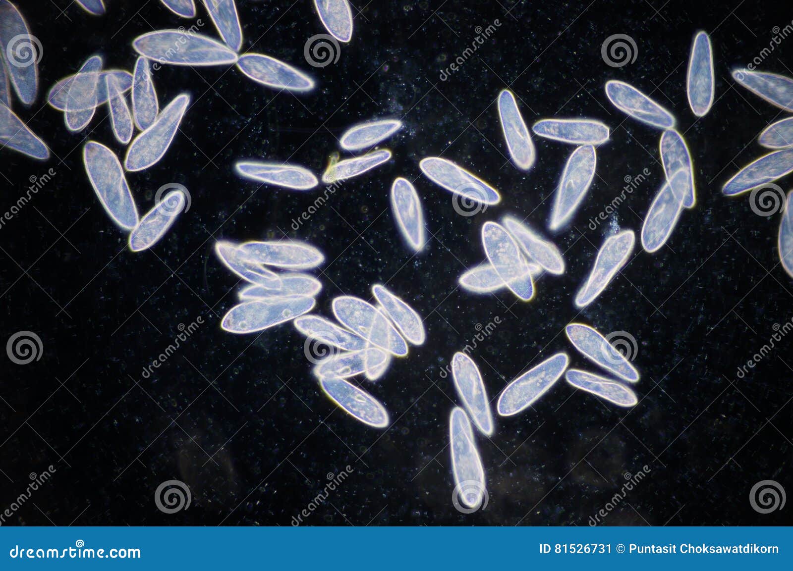 Paramecium immagine stock. Immagine di microorganismo - 81526731