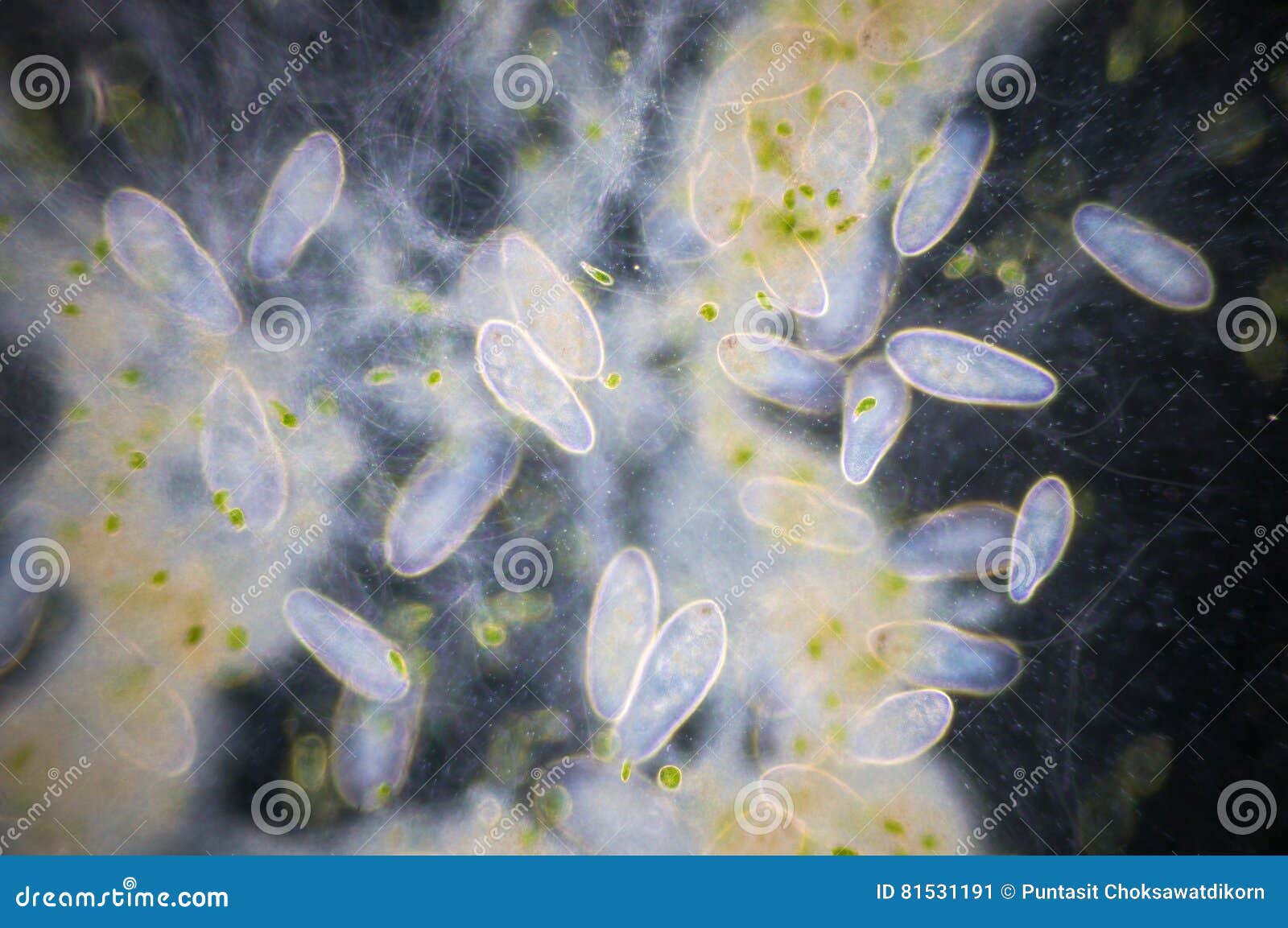 Paramecium imagen de archivo. Imagen de médico, fondo - 81531191