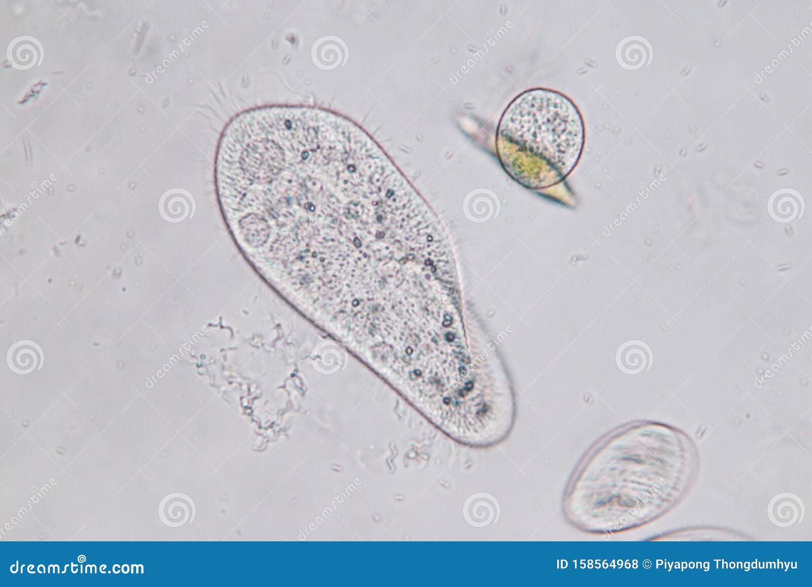 Paramecium Caudatum 400x