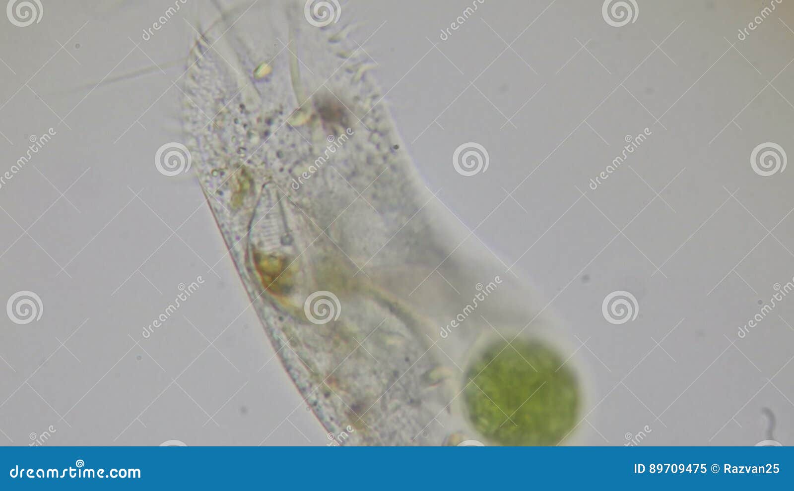Paramecium Ciliates Under the Microscope in 4k Stock Video - Video of ...