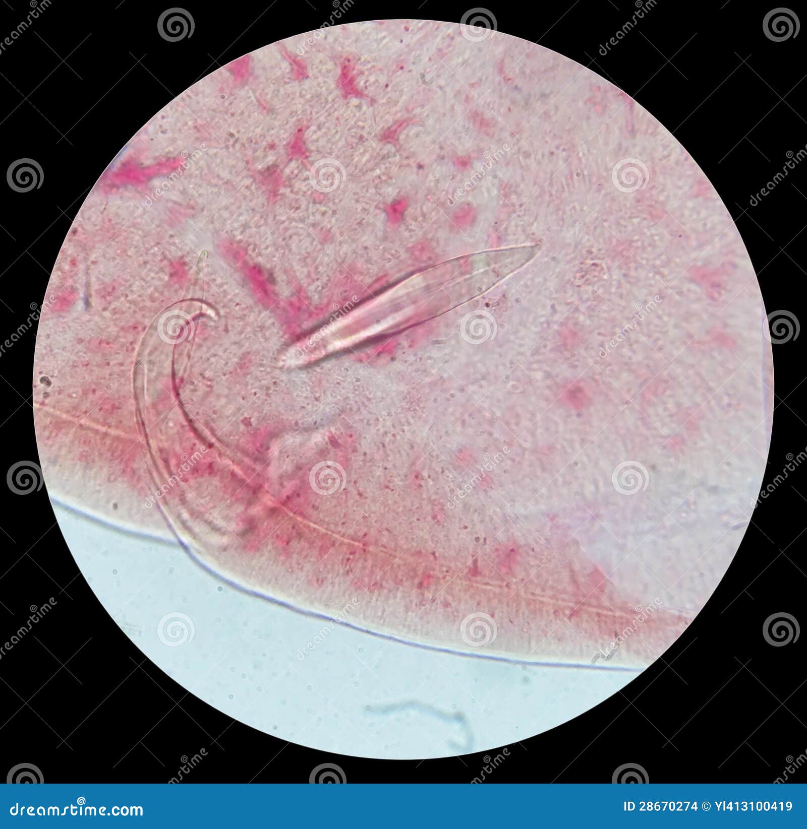 Parasite photo stock. Image du détail, recherche, science - 28670274