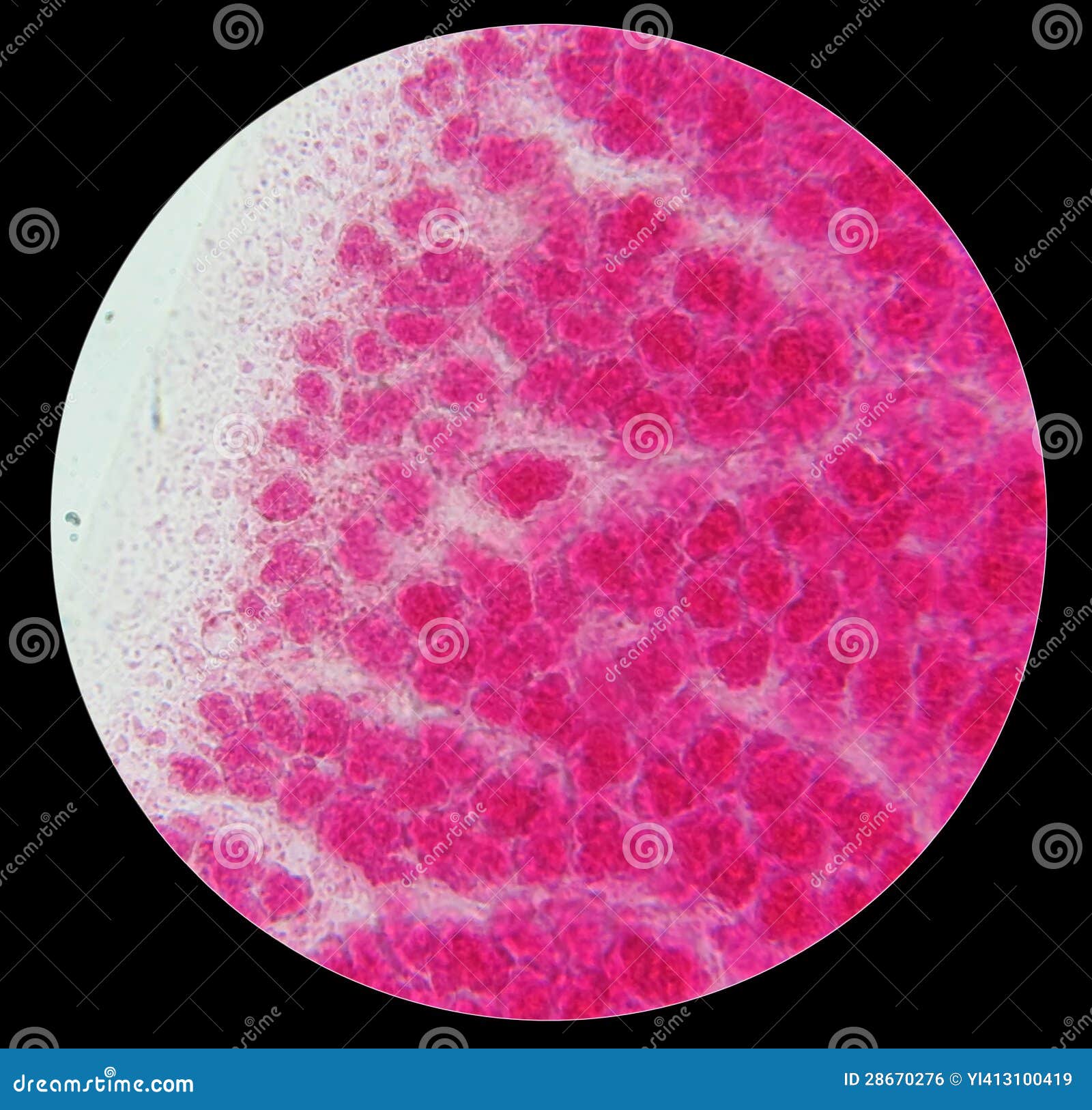 Parasite photo stock. Image du substance, biologique - 28670276