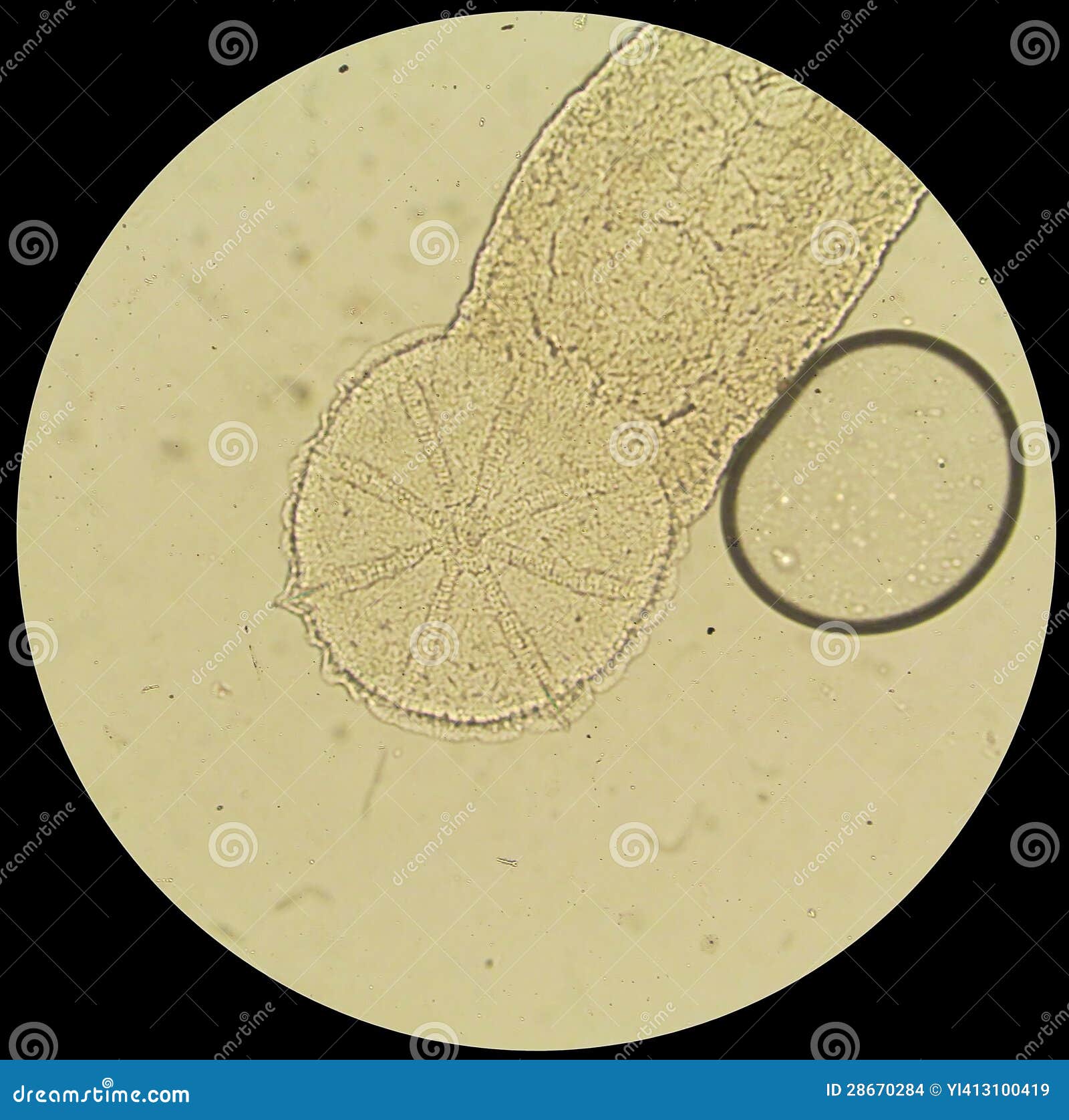 Parasite stock photo. Image of stuff, micro, microscope - 28670284