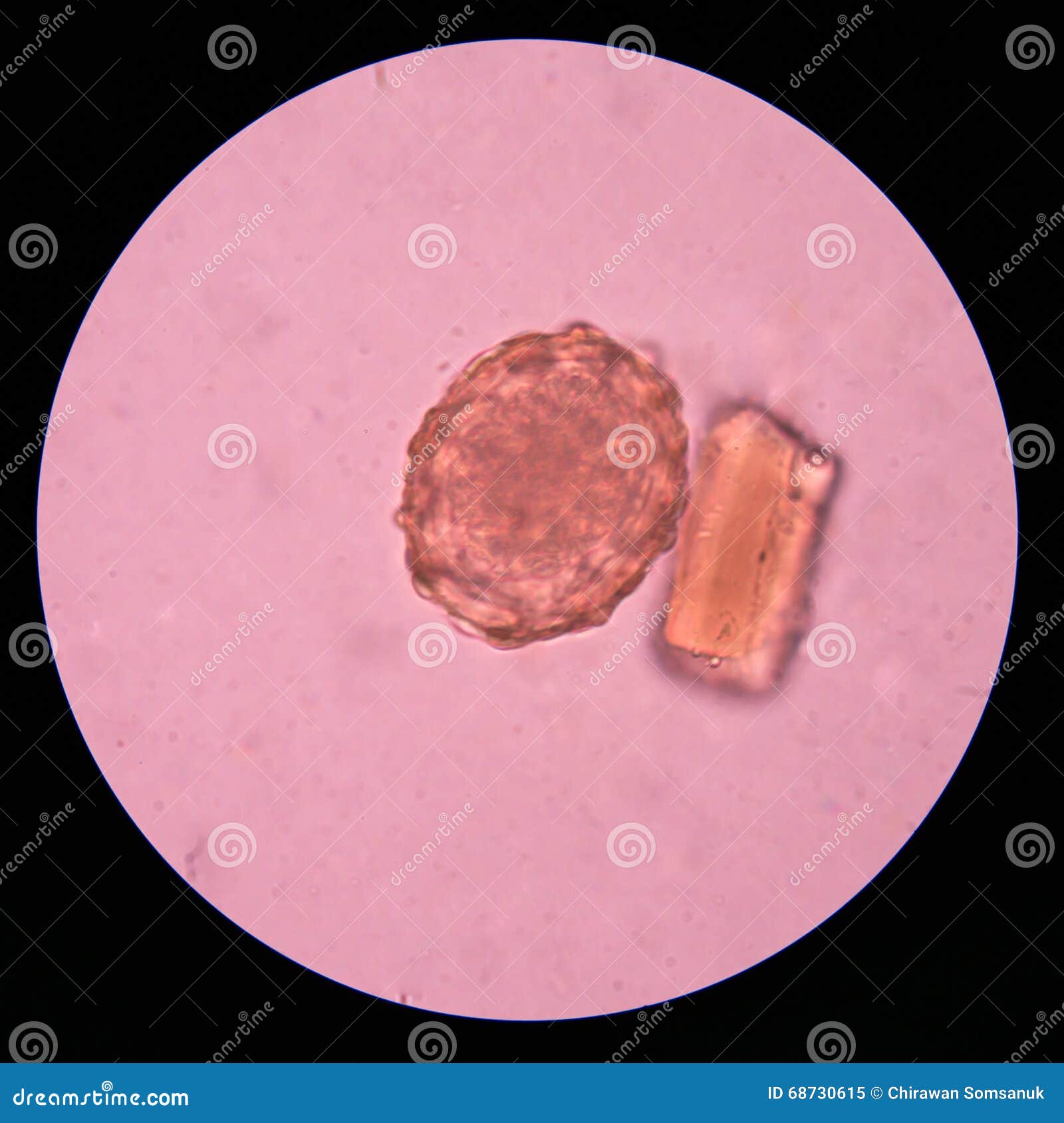 Parasite Egg in Stool Exam. Stock Image - Image of science, biology ...