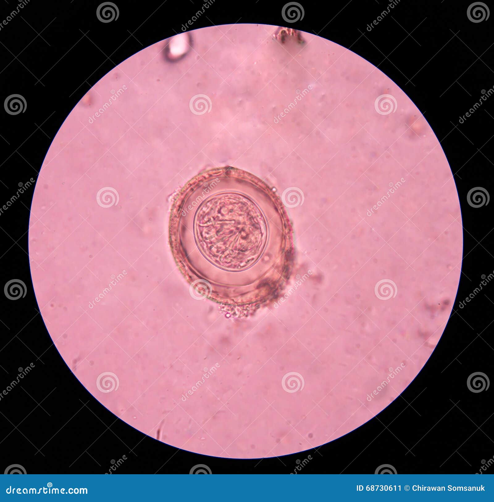 Parasite Egg in Stool Exam. Stock Image - Image of histology, disease ...