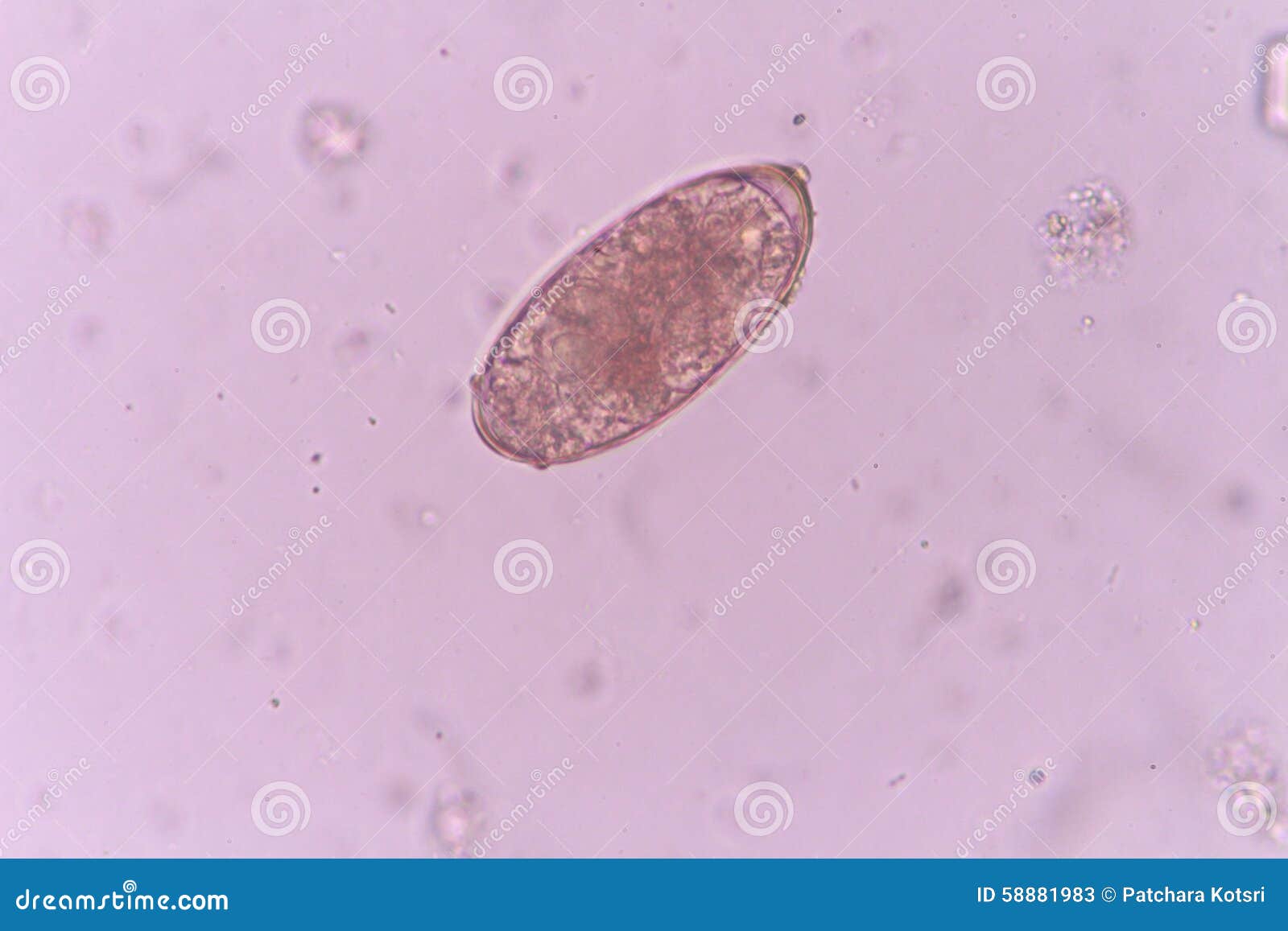 Microscopic Parasites