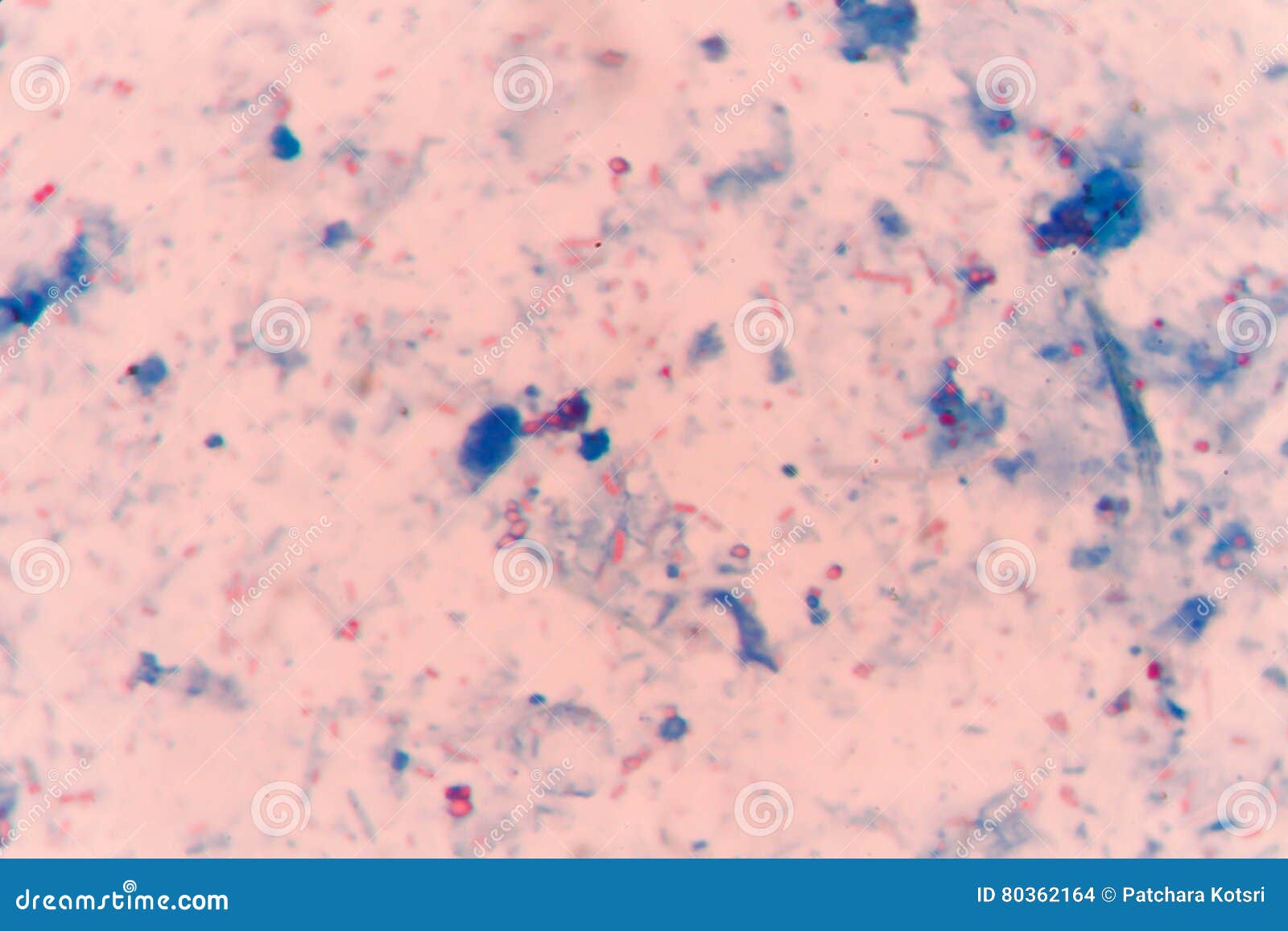 Parasites microsporidia stock photo. Image of microscope - 80362164