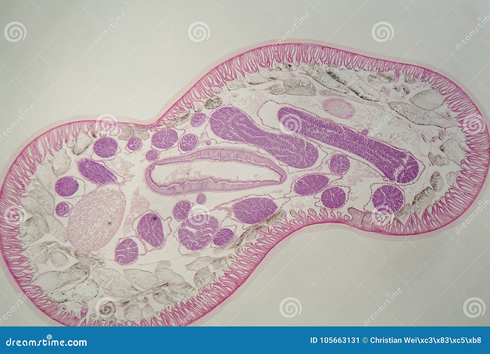 Eggs Of Ascaris Lumbricoides (roundworm) Stock Photo | CartoonDealer ...