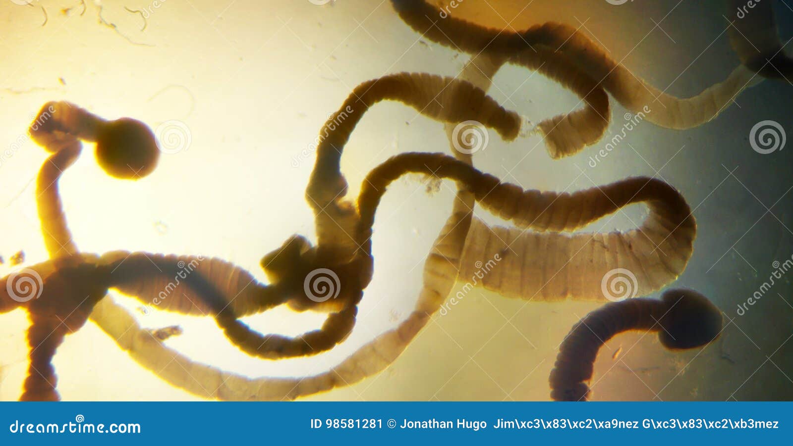 Parassiti al microscopio immagine stock. Immagine di vite - 98581281