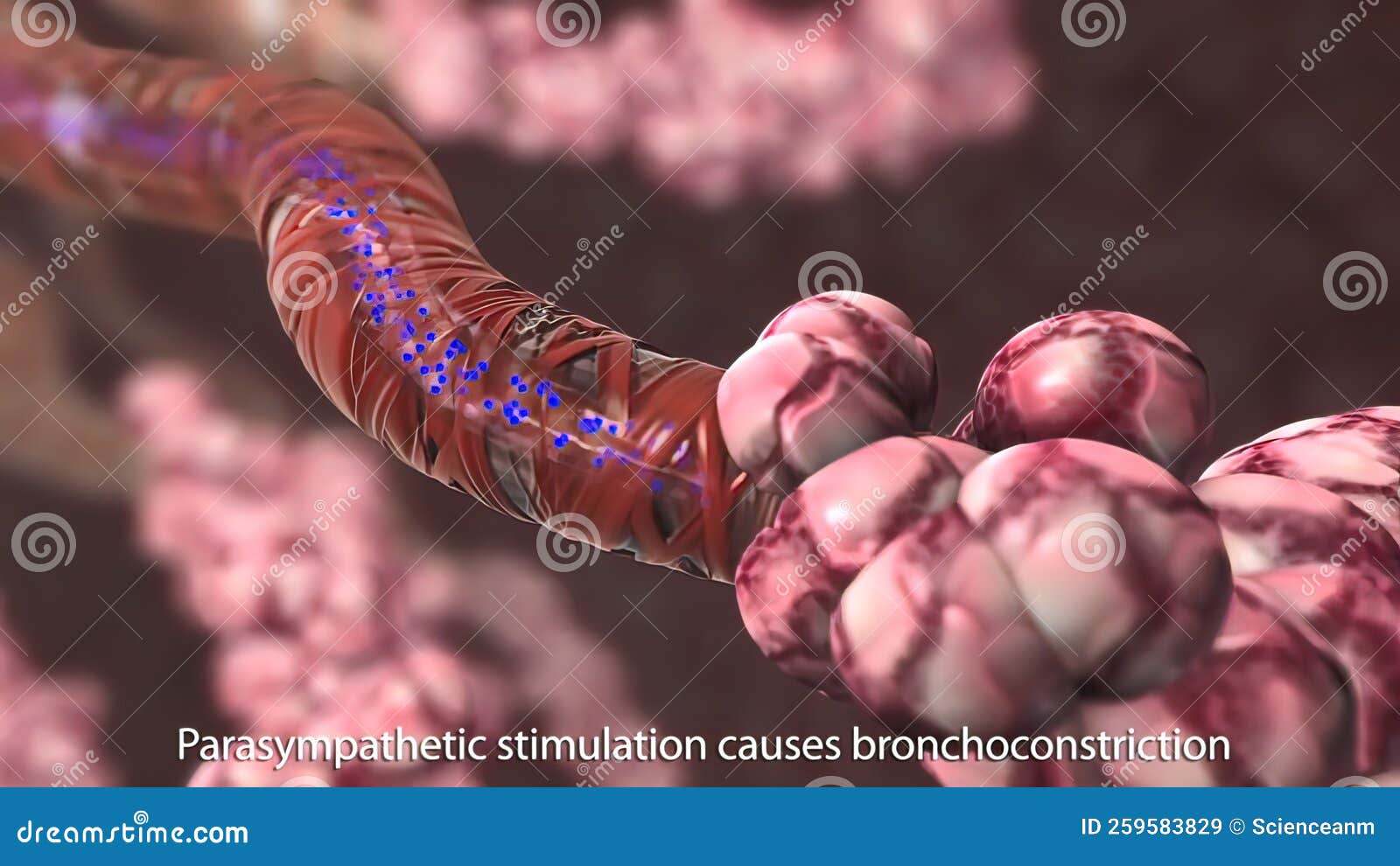 Parasympathetic Stimulation Causes Bronchoconstriction Stock ...
