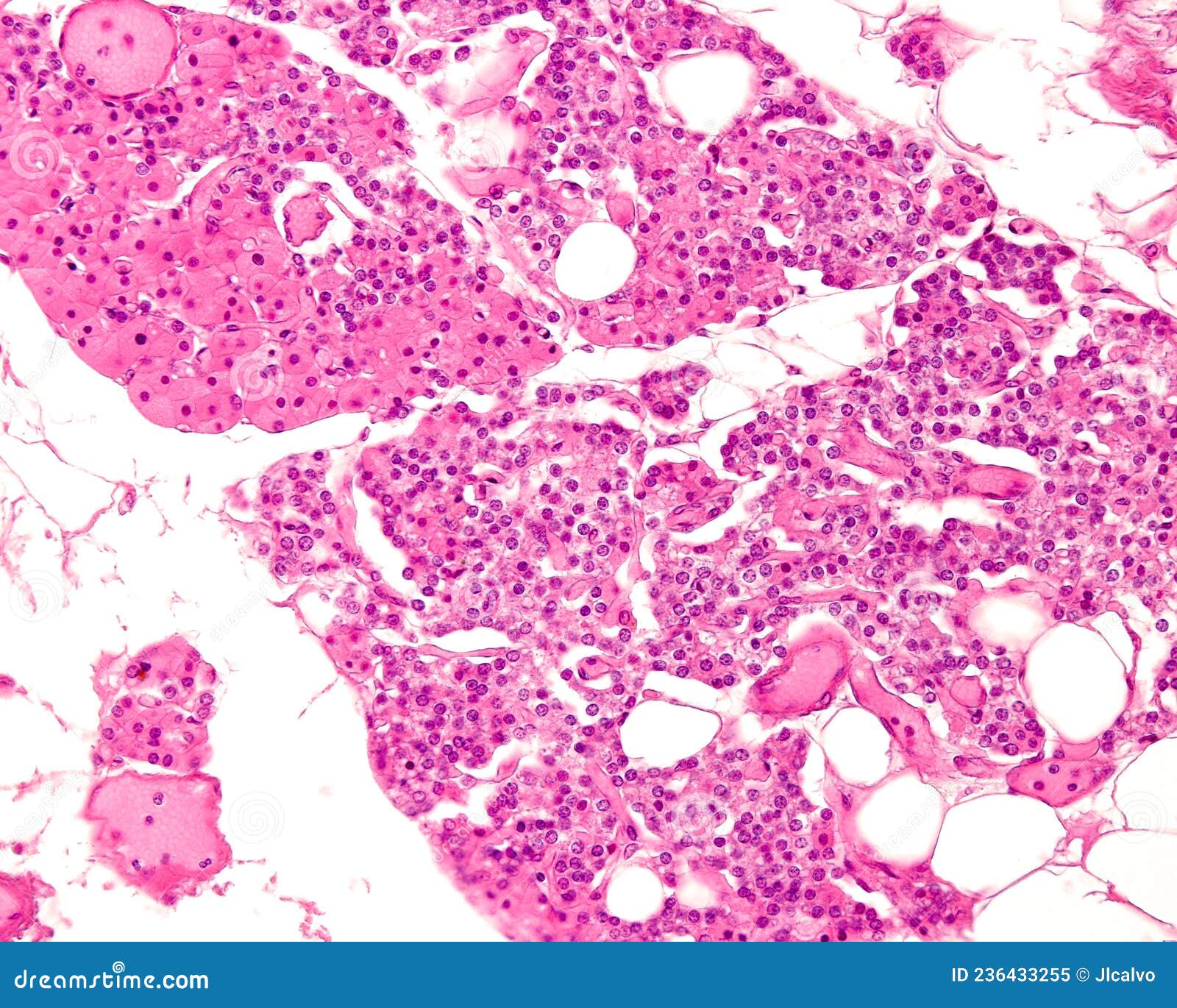 Parathyroid Gland. Cell Types Stock Image - Image of microscope, nuclei ...