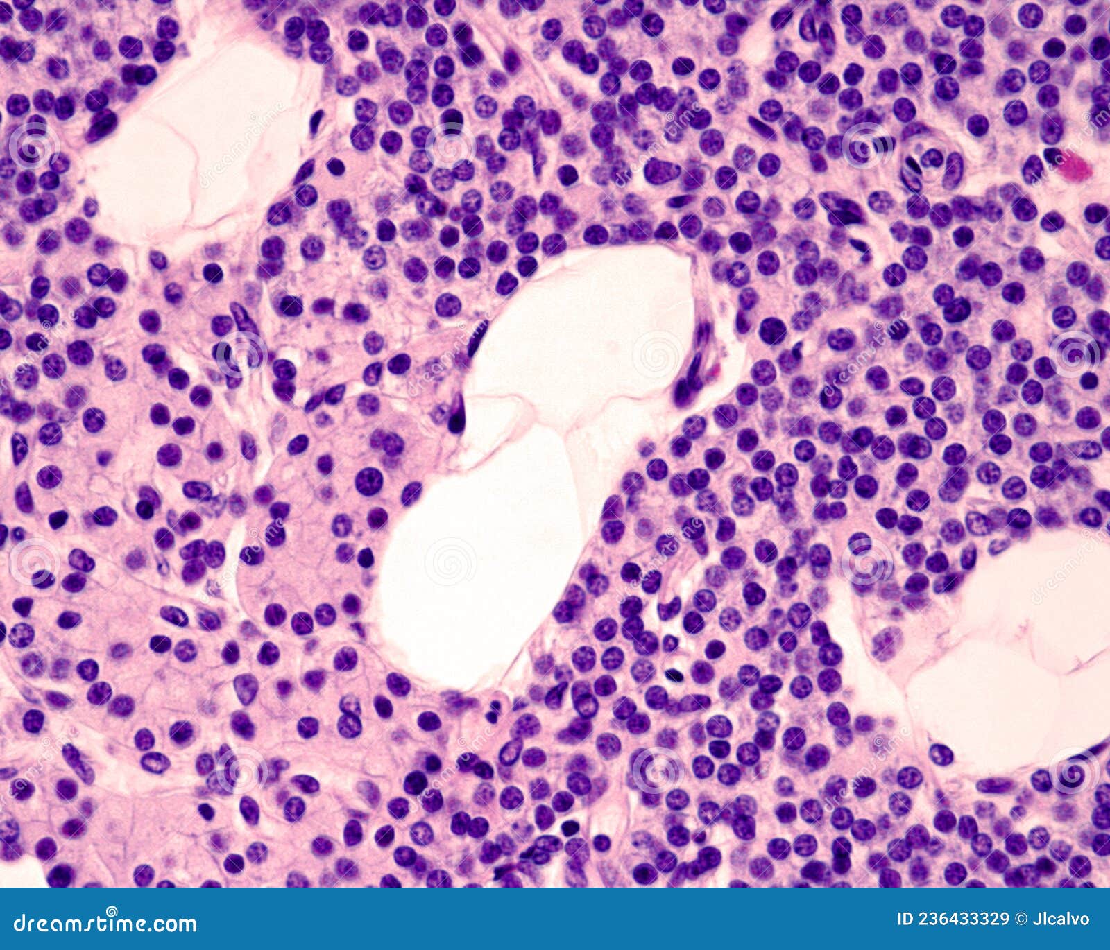 Parathyroid Gland. Cell Types Stock Image - Image of healthy ...