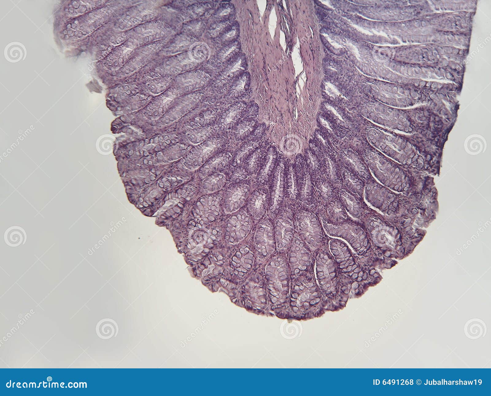 Pared Del Intestino Grande Mamífera Foto de archivo - Imagen de ...