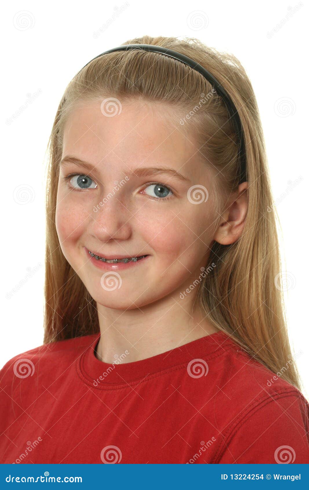 Parentesi graffe dentali fotografia stock. Immagine di aperto - 13224254