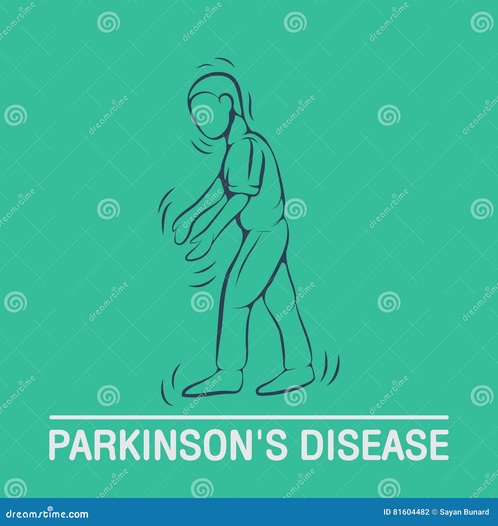 Eye Disease Vector Illustration / Herpetic Keratitis | CartoonDealer ...