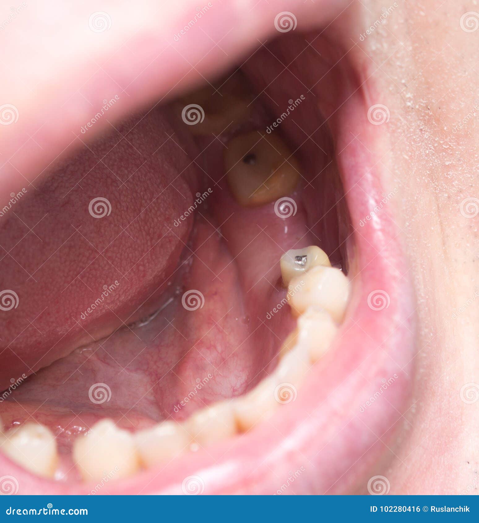 Toothless stock photo. Image of chin, tooth, dentistry - 102280416