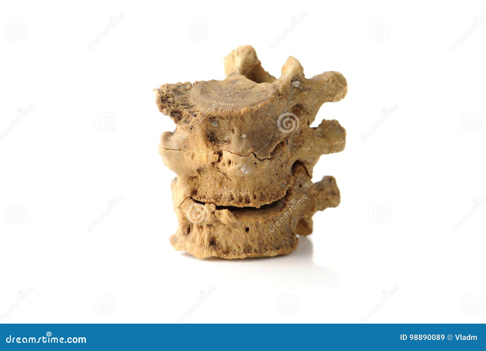 Part of Human Spine, Backbone, on White. Stock Image - Image of ...