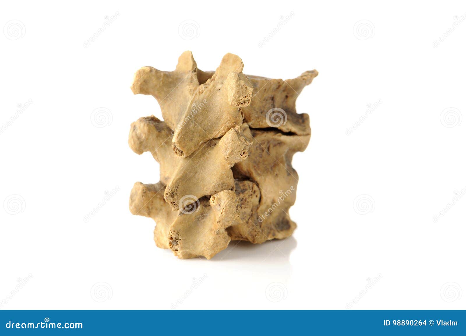 Part of Human Spine, Backbone, on White. Stock Photo - Image of ...
