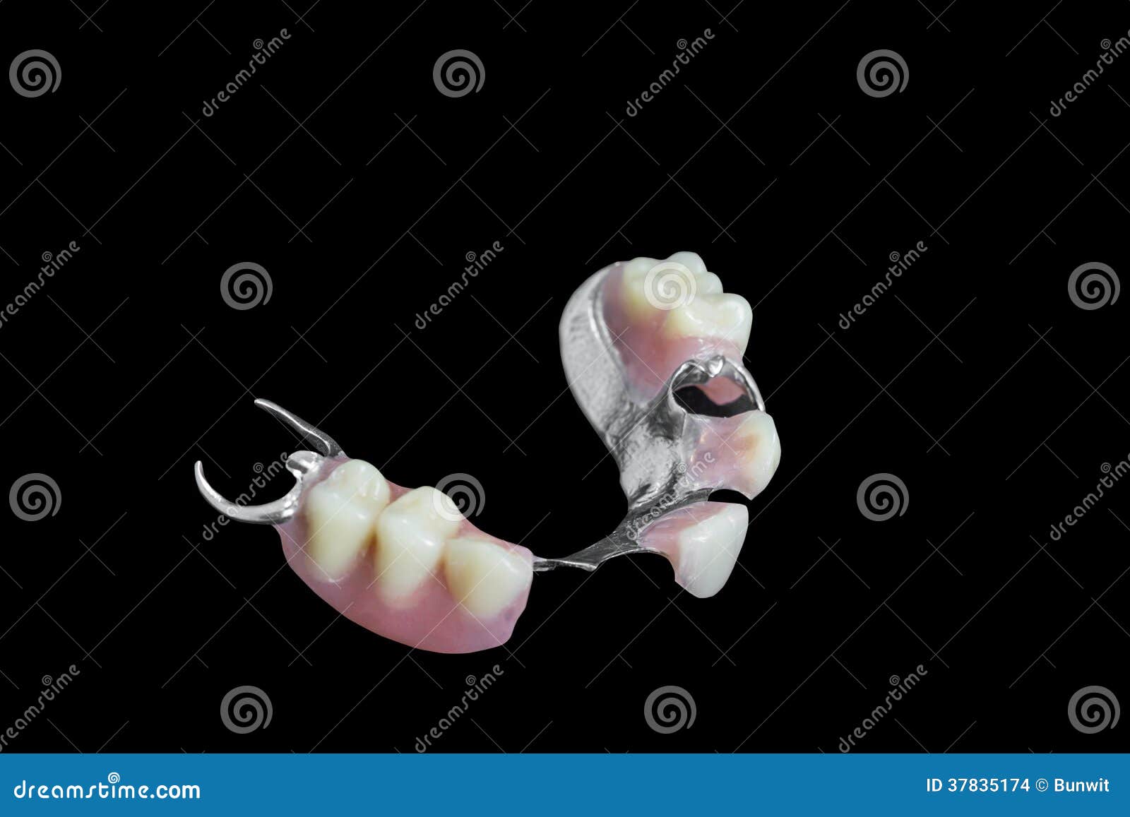 Partial Denture Upper Side On A White Background Stock Photo ...