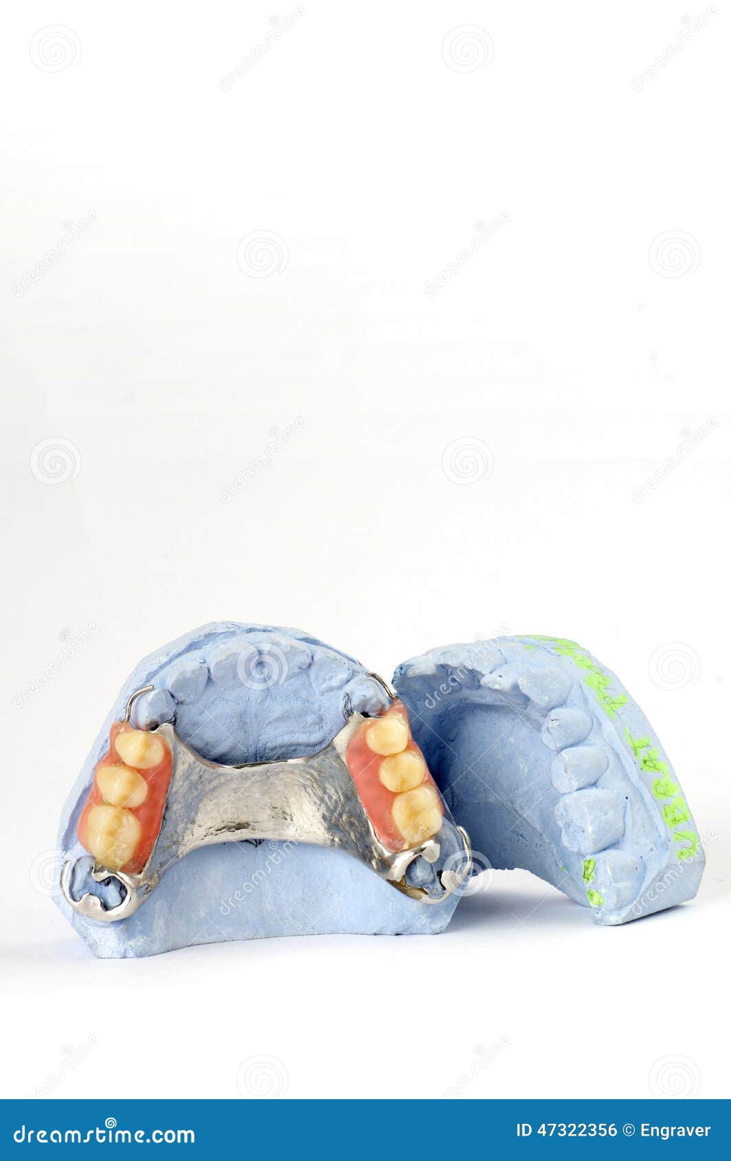 Partial Denture Upper Side On A White Background Stock Photo ...