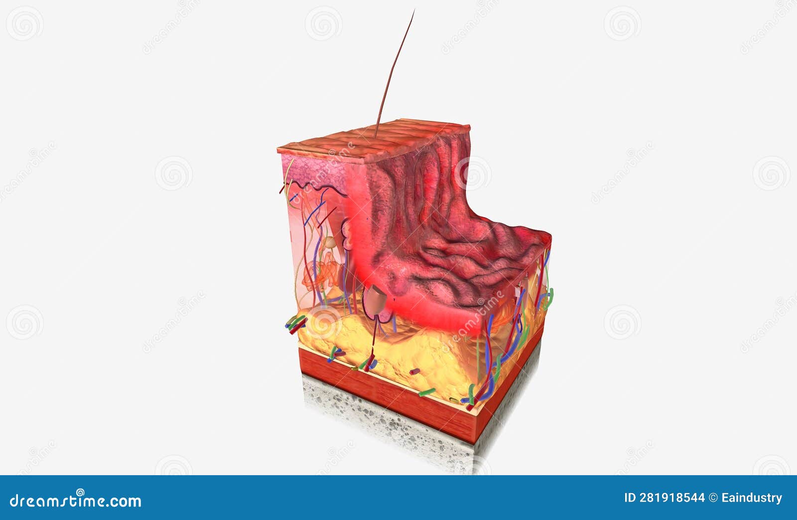 Partial Thickness Wound in Skin Tissue Stock Illustration ...