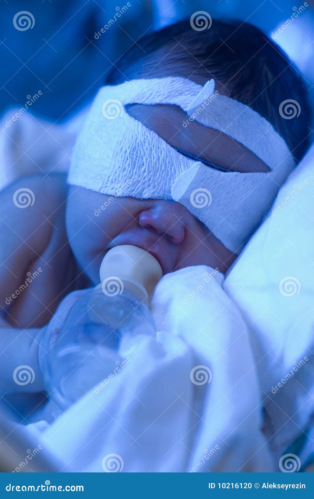 Pasgeboren Baby Onder Ultraviolet Licht Stock Foto - Image of geboren ...