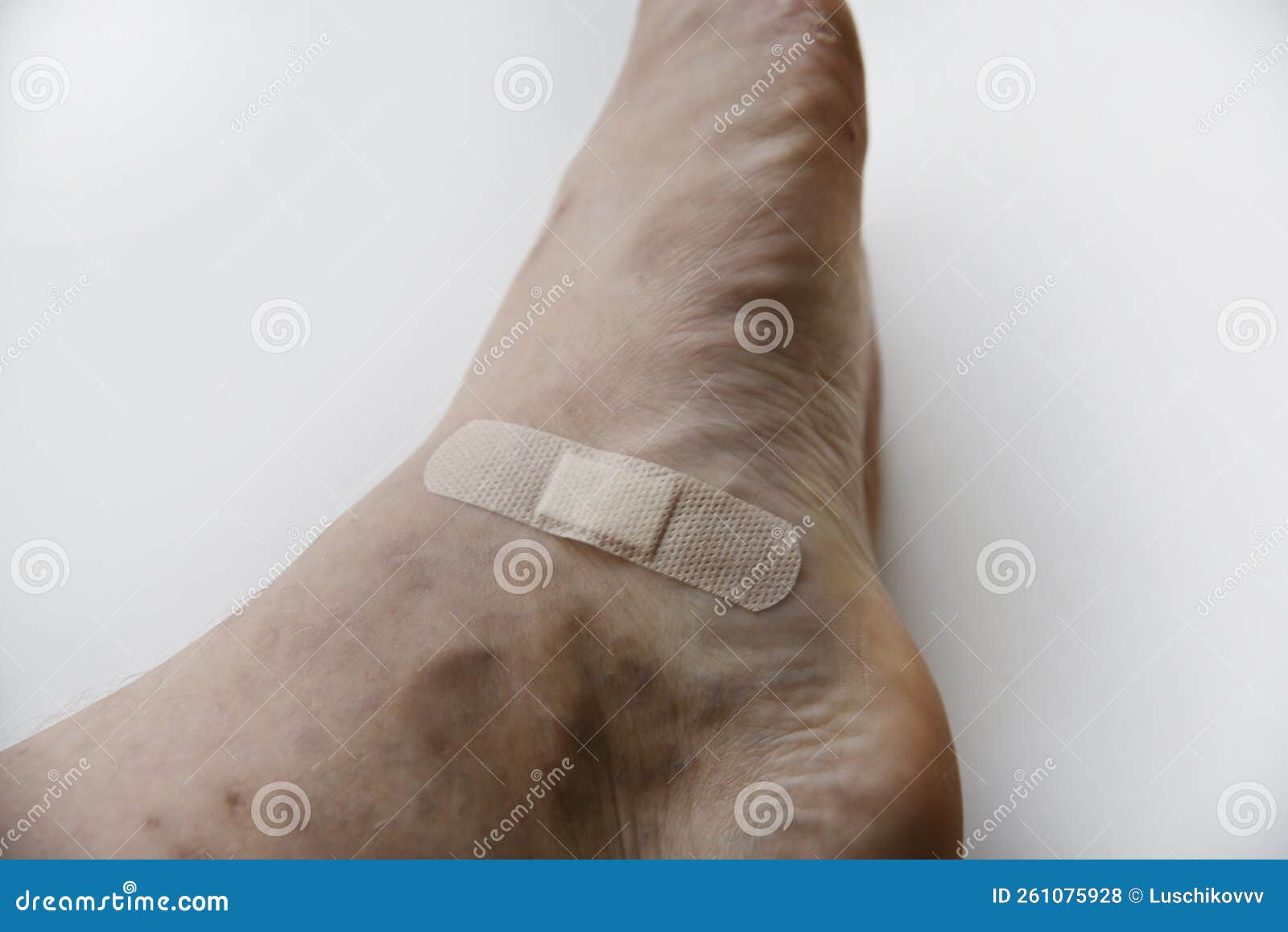 A Patch on a Man S White Leg. the Patch on the Leg Wound is a Close-up ...