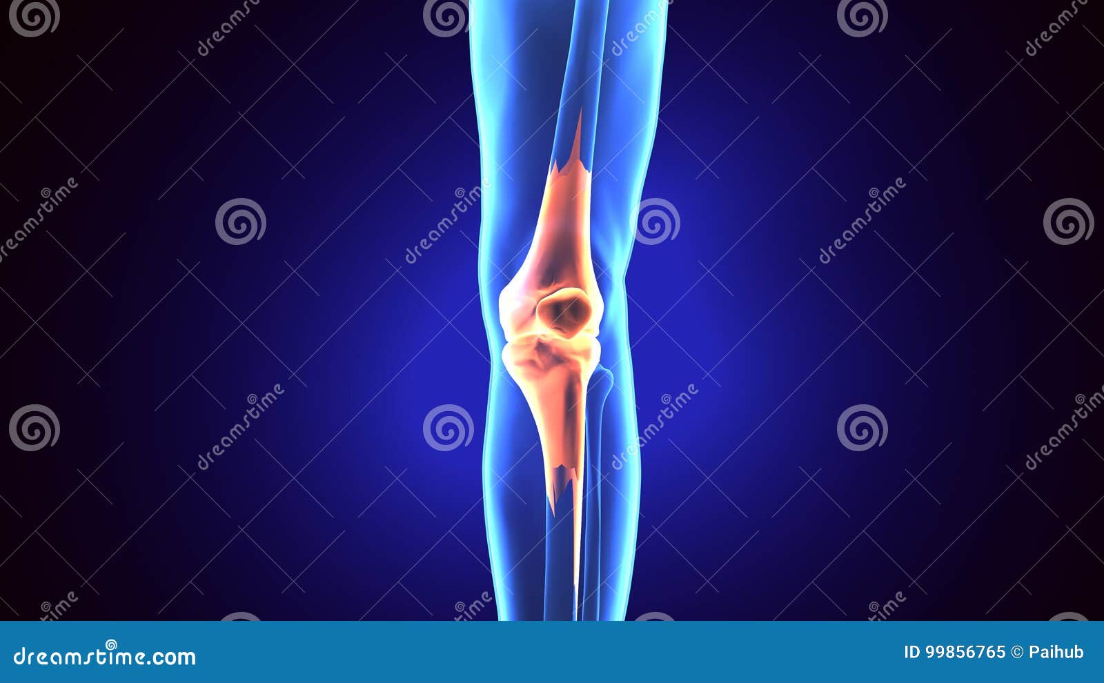 3D Illustration of Patella - Part of Human Skeleton. Stock Illustration ...