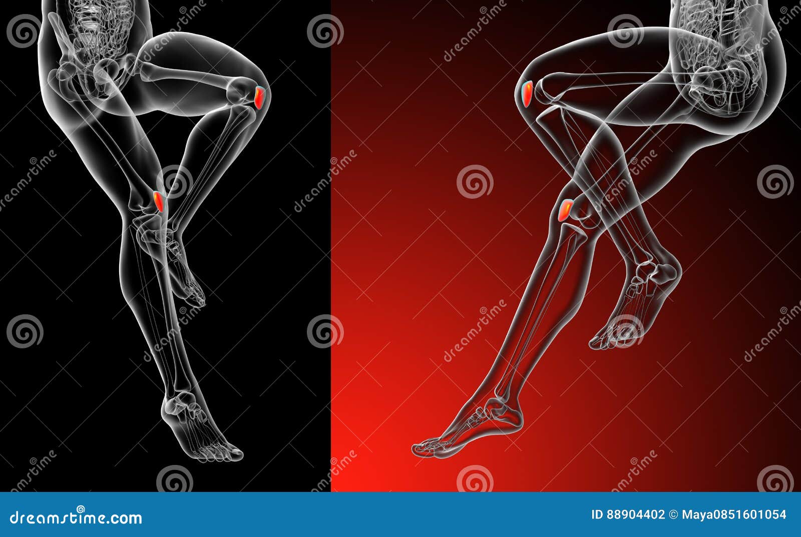 Patella Cartoons, Illustrations & Vector Stock Images - 4890 Pictures ...