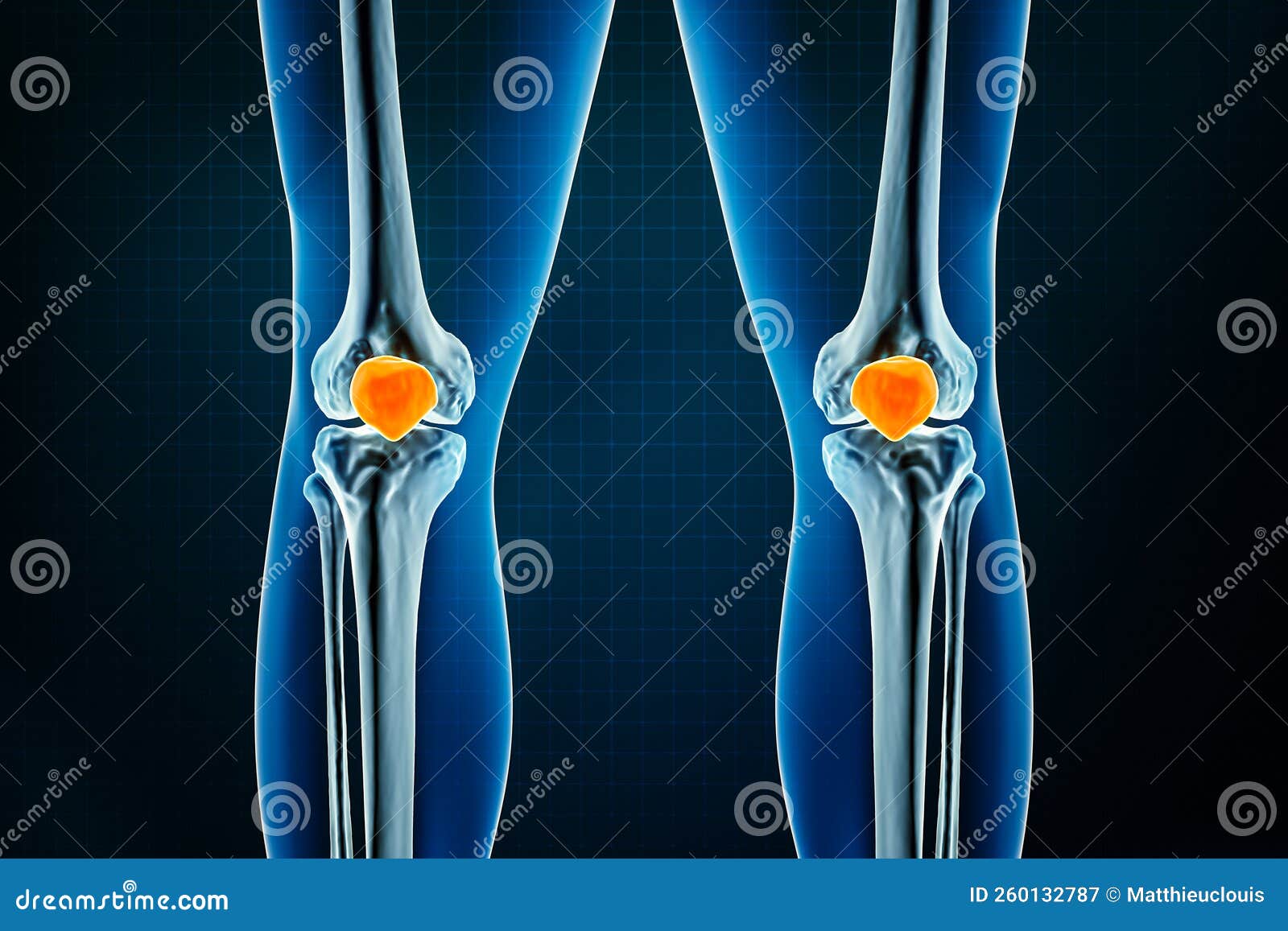 Patella Or Kneecap Bone X Ray Front Or Anterior View Osteology Of The Human Skeleton Leg Or