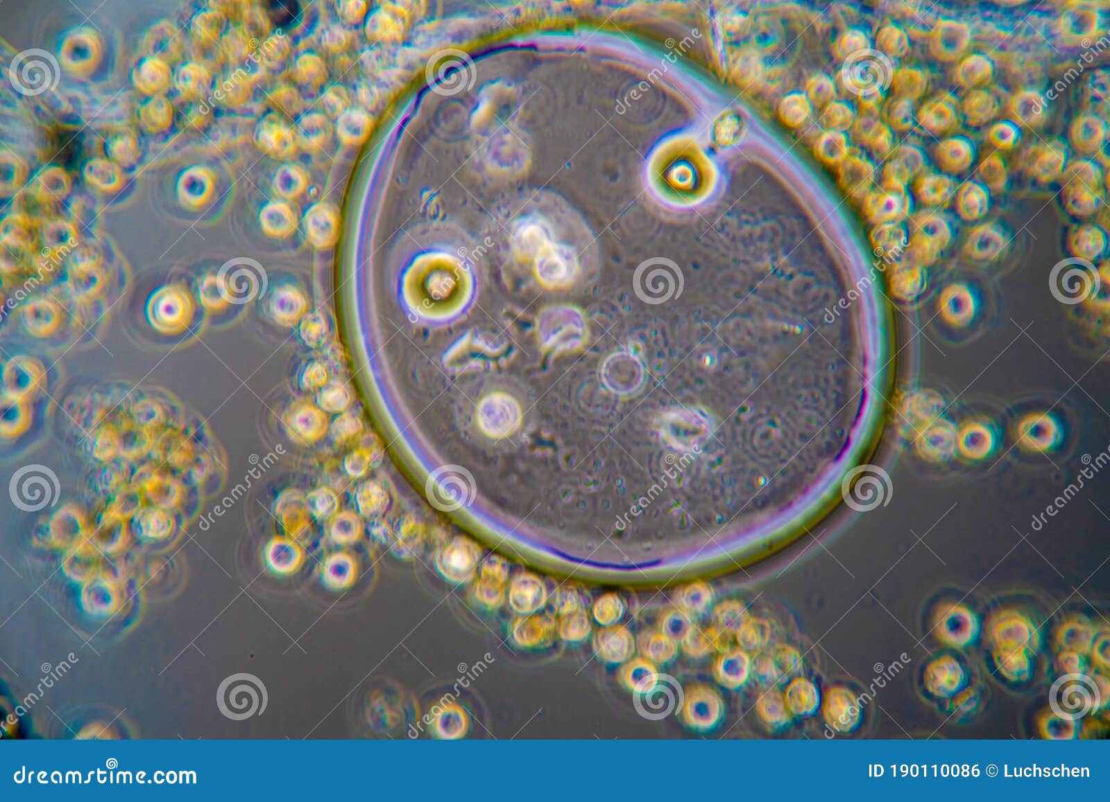 Pathogens Magnified by a Microscope Stock Photo - Image of magnified ...