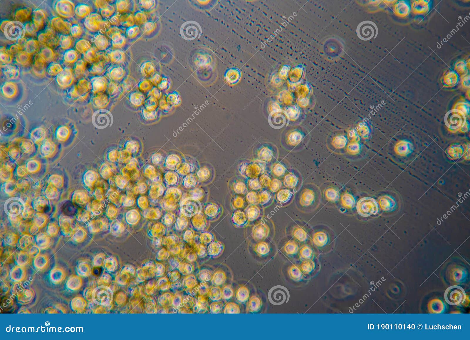 Pathogens Magnified by a Microscope Stock Photo - Image of color ...