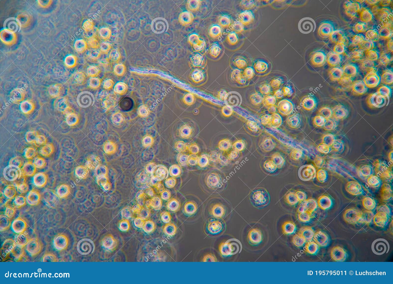 Pathogens Magnified by a Microscope Stock Image - Image of color ...