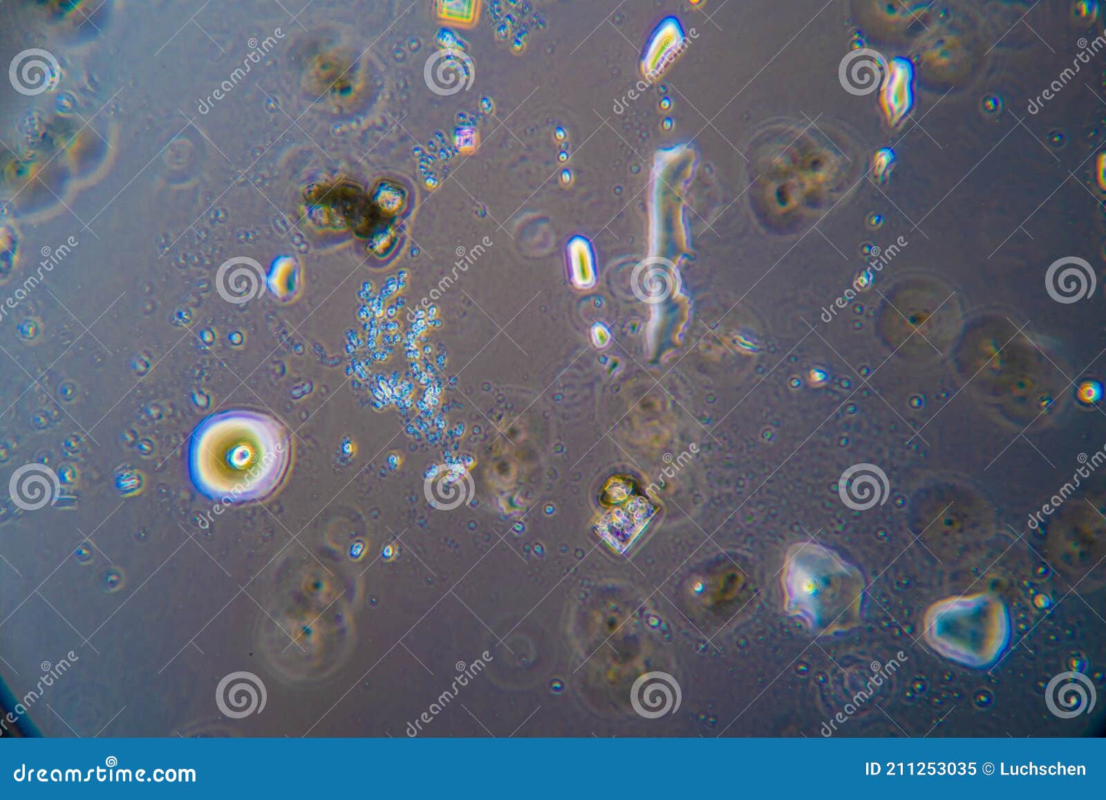 Pathogens Magnified by a Microscope Stock Image - Image of biological ...