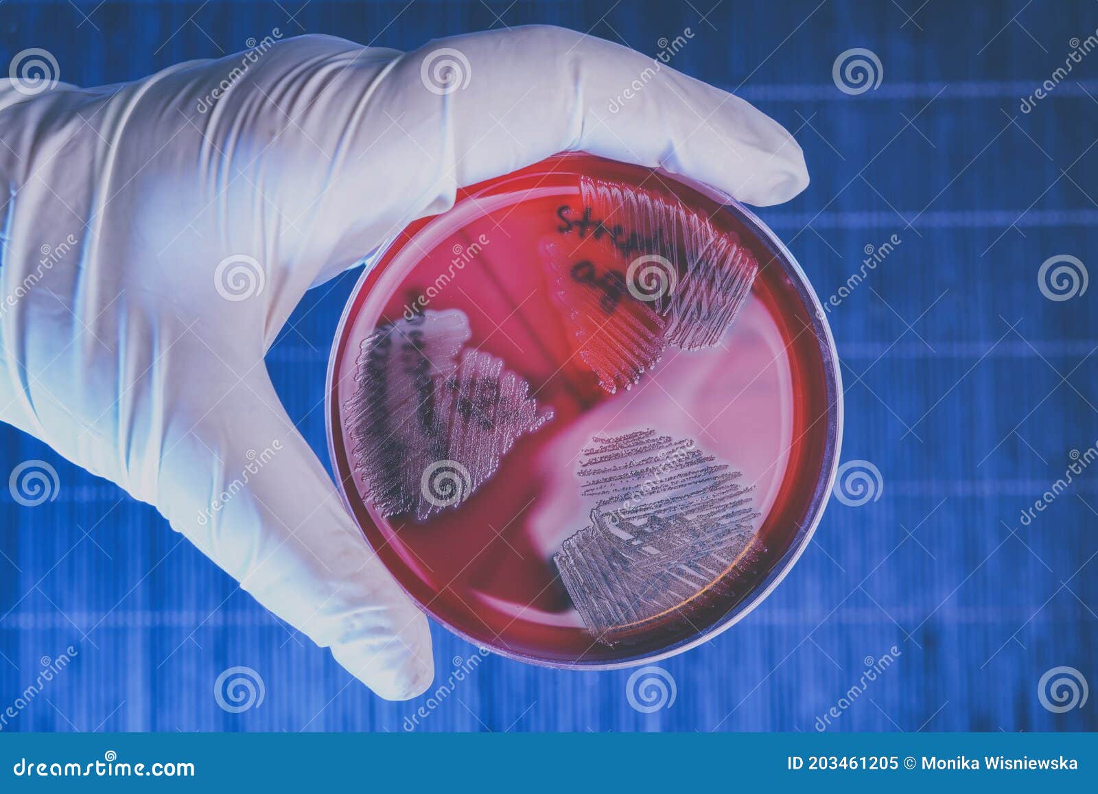 Pathological bacteria stock image. Image of germs, examination - 203461205
