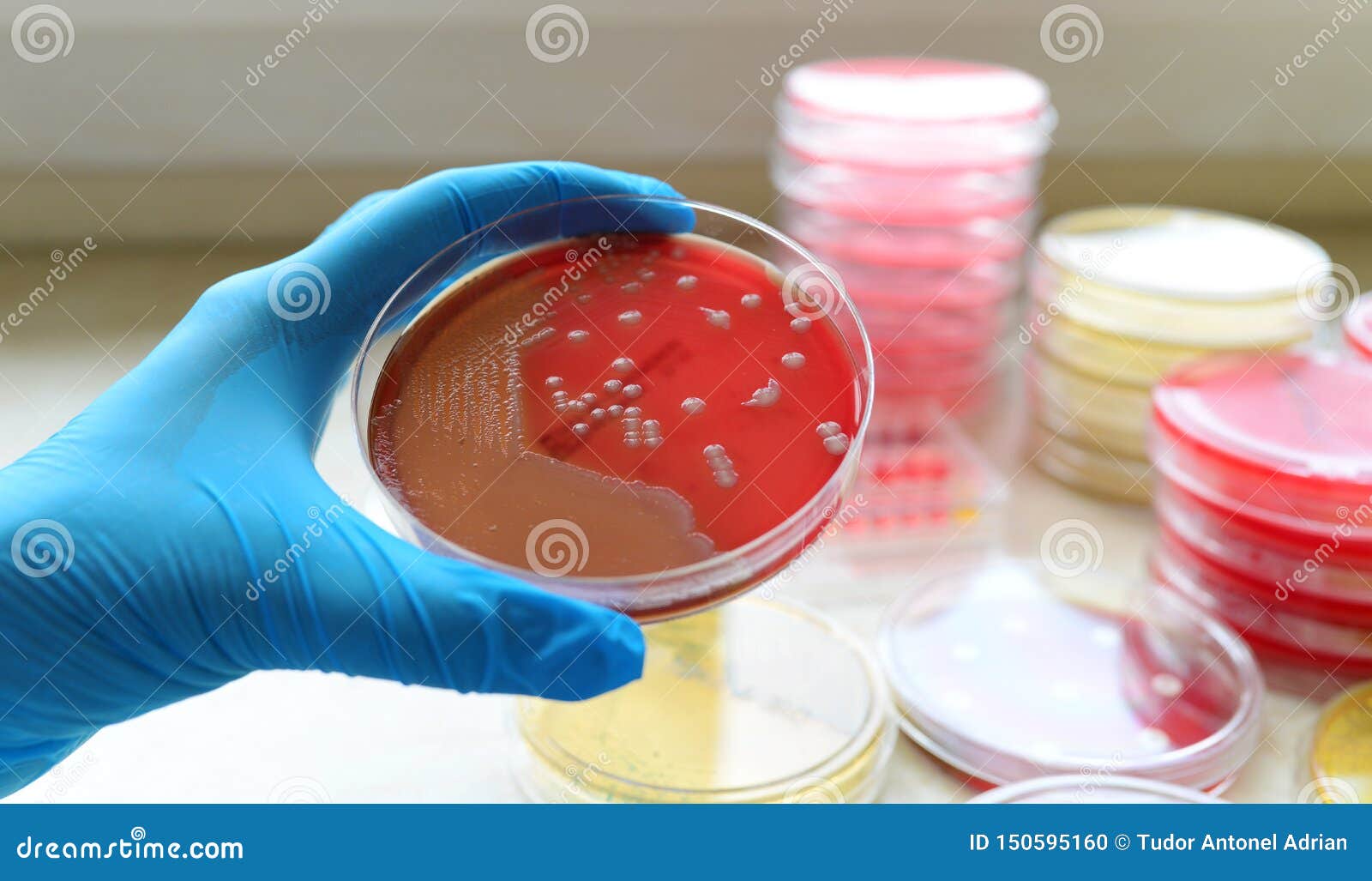 Pathological bacteria test stock photo. Image of clinic - 150595160
