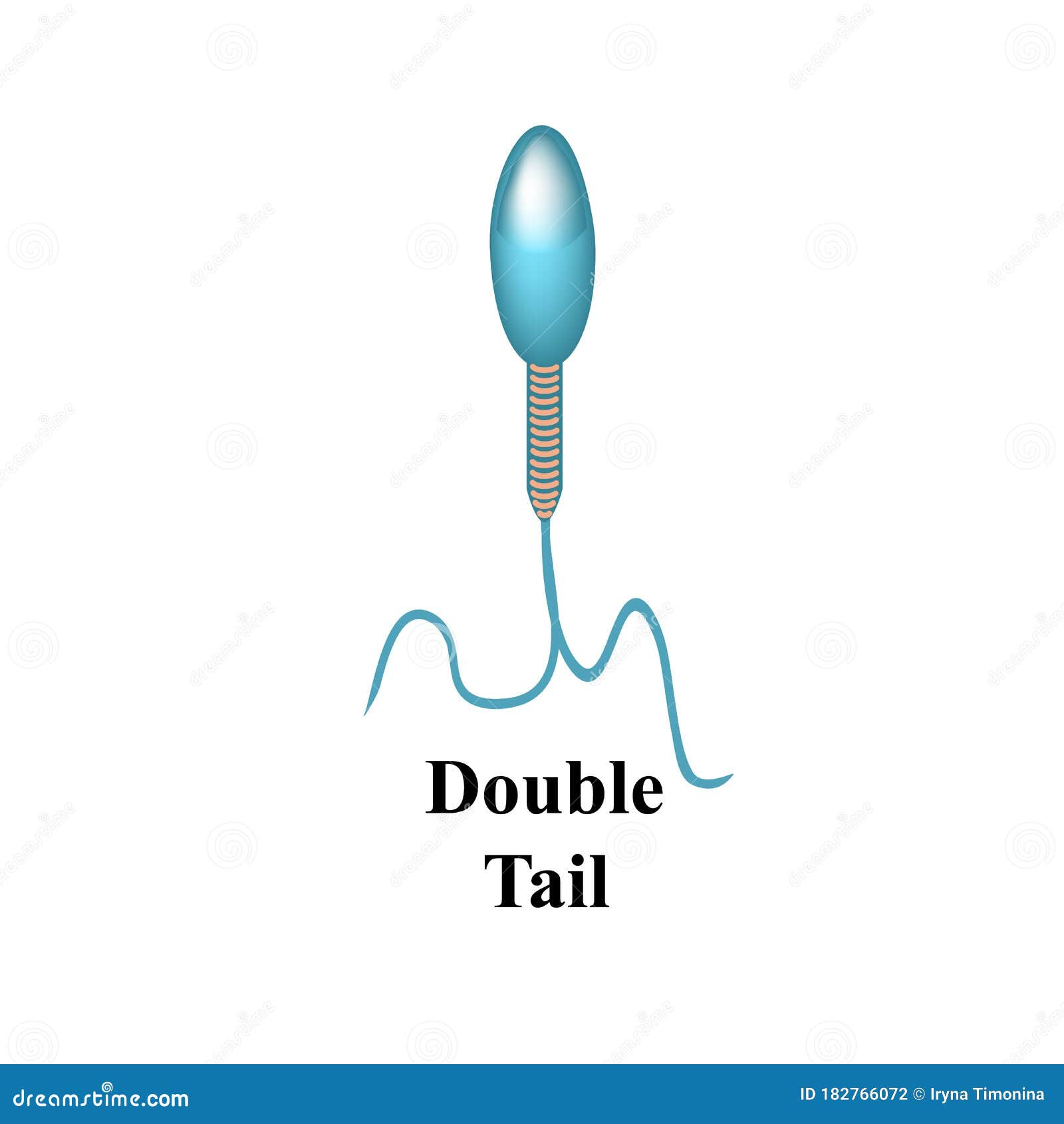 Pathological Forms of Sperm in the Ejaculate. Male Infertility ...