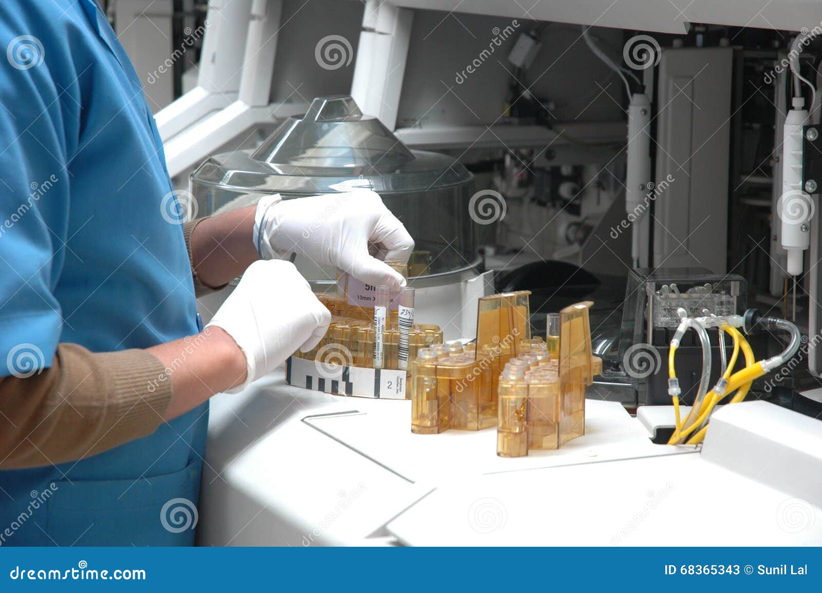 Pathology stock image. Image of fractionation, transfusion - 68365343