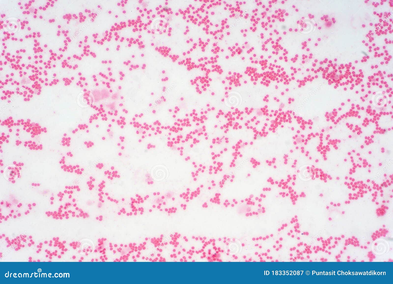 Pathology Study Of Human Stem Cell Under Microscope Royalty-Free Stock ...