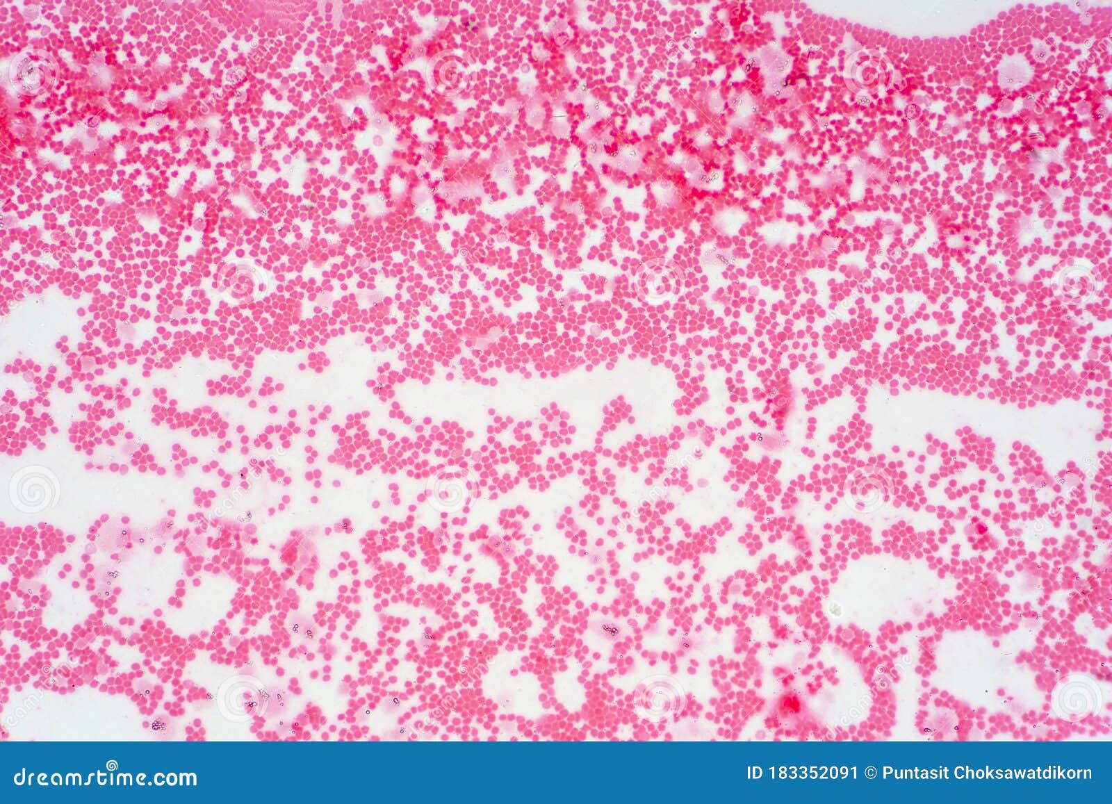 Pathology Study of Human Stem Cell Under Microscope Stock Image - Image ...