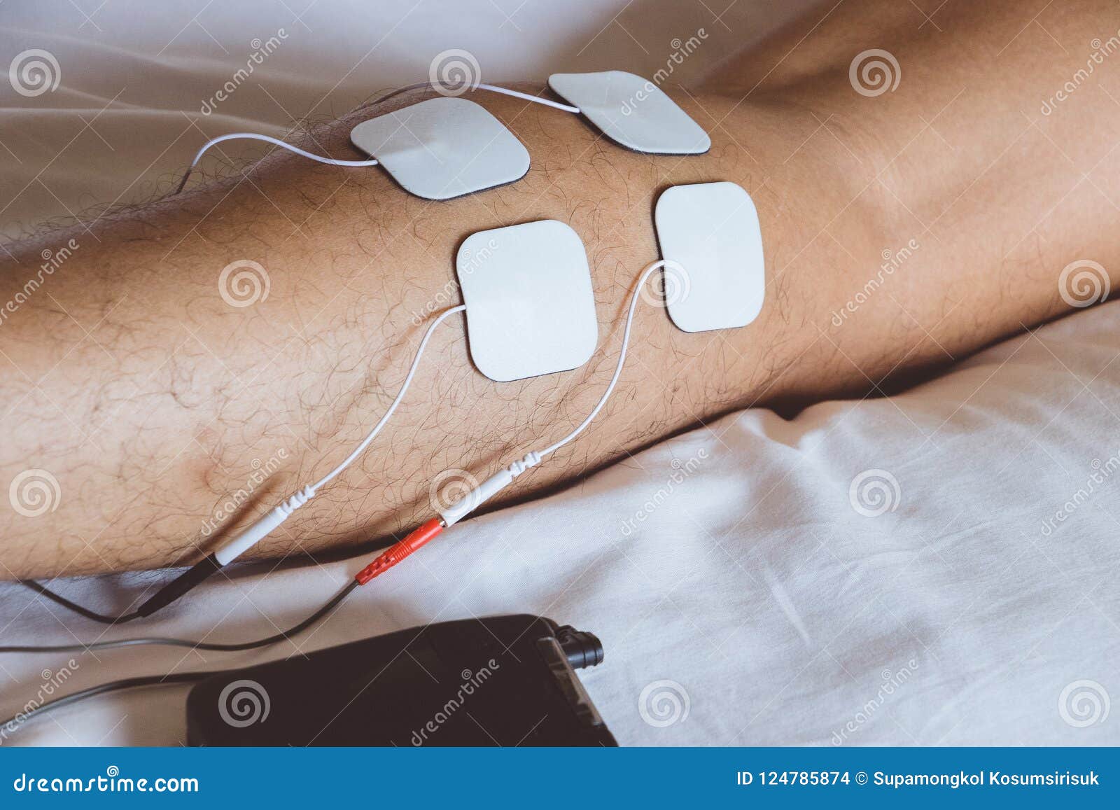 Patient Appliquant La Stimulation électrique Photo stock - Image du ...