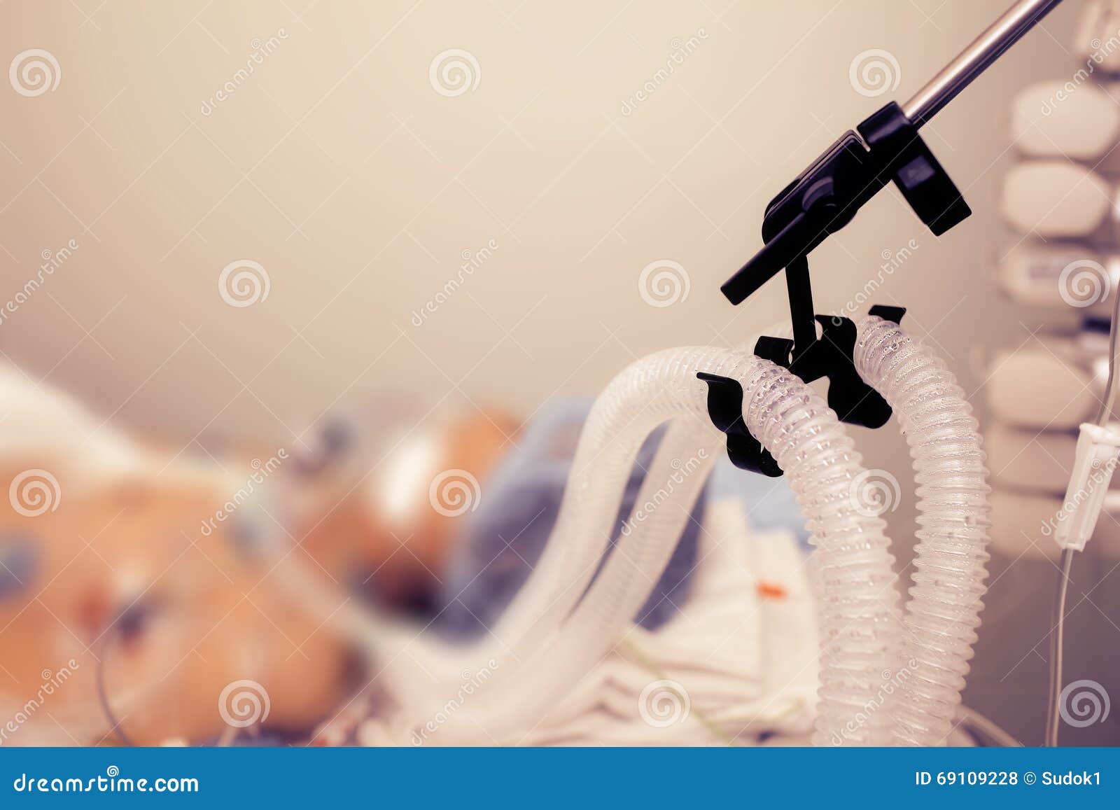 Patient on the Artificial Lung Ventilation Stock Photo - Image of ...