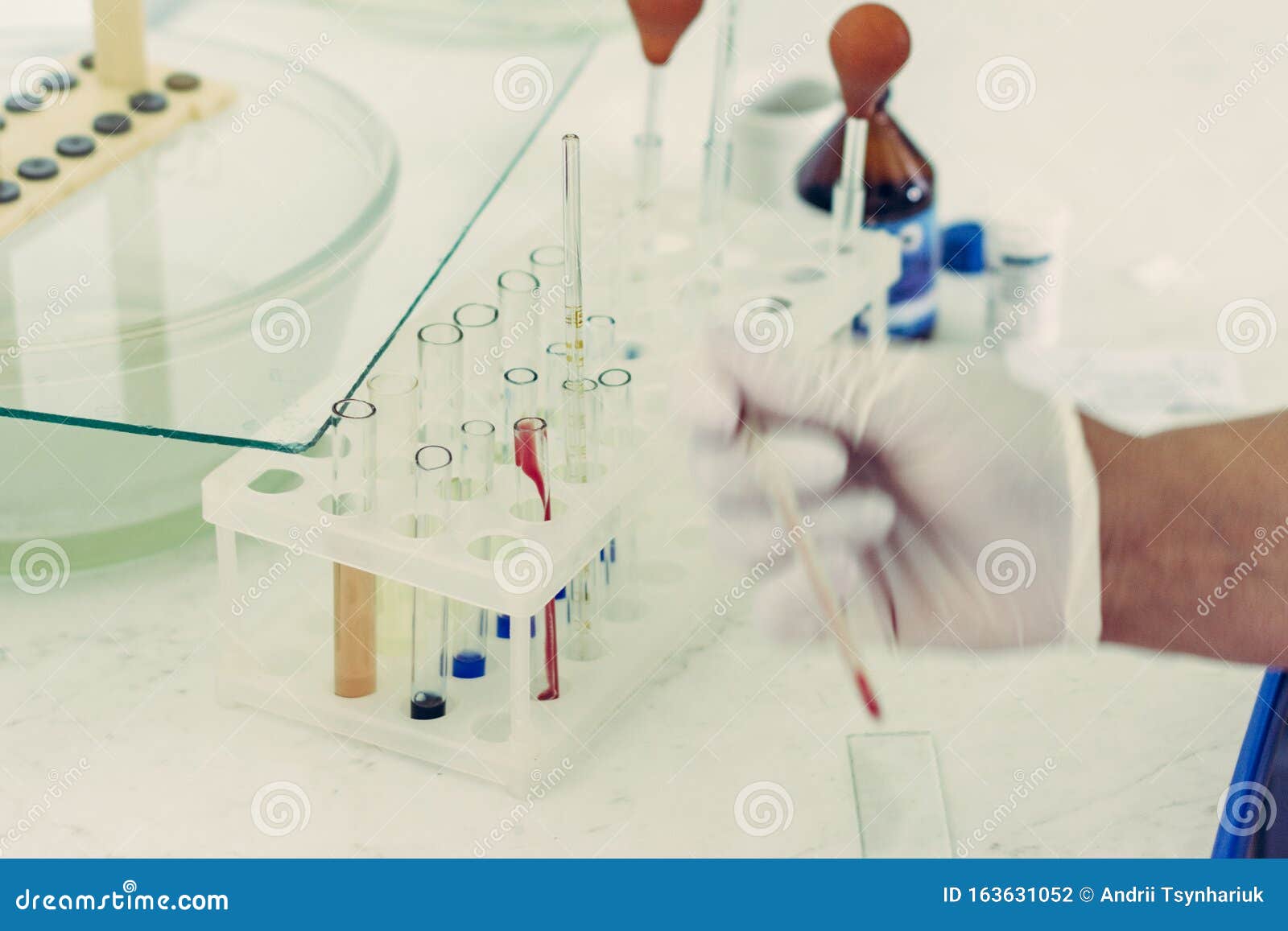 Patient Blood Sampling by a Laboratory Technician for General Blood ...
