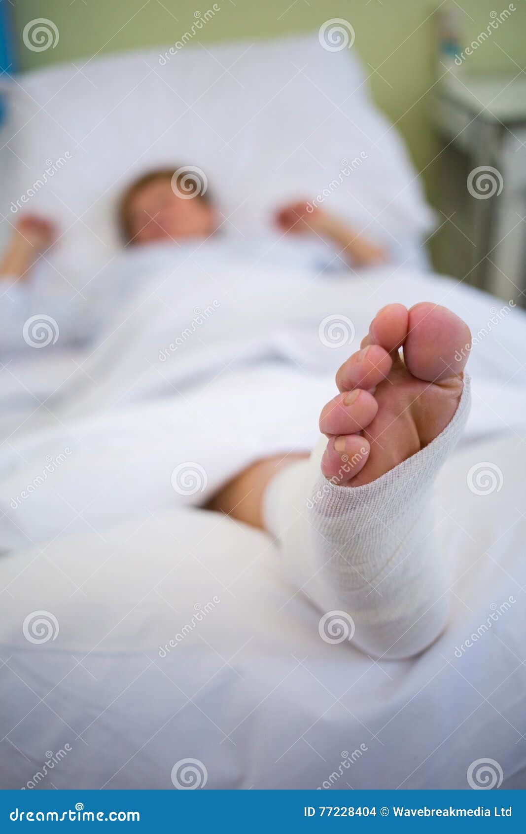 Patient with Broken Leg in a Plaster Cast Stock Photo - Image of ...
