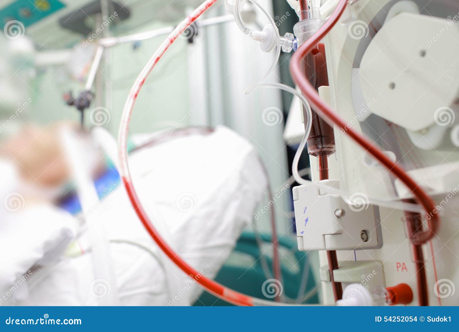 Patient on Cardiopulmonary Bypass Device in Intensive Care Stock Photo ...