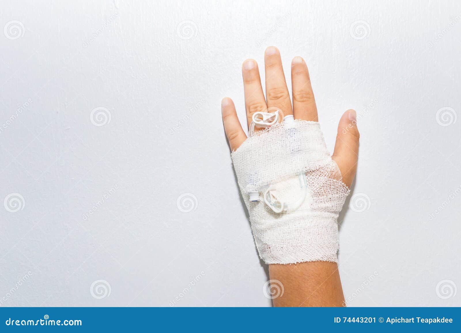 Patient Child Hand with Saline Intravenous Stock Image - Image of pump ...