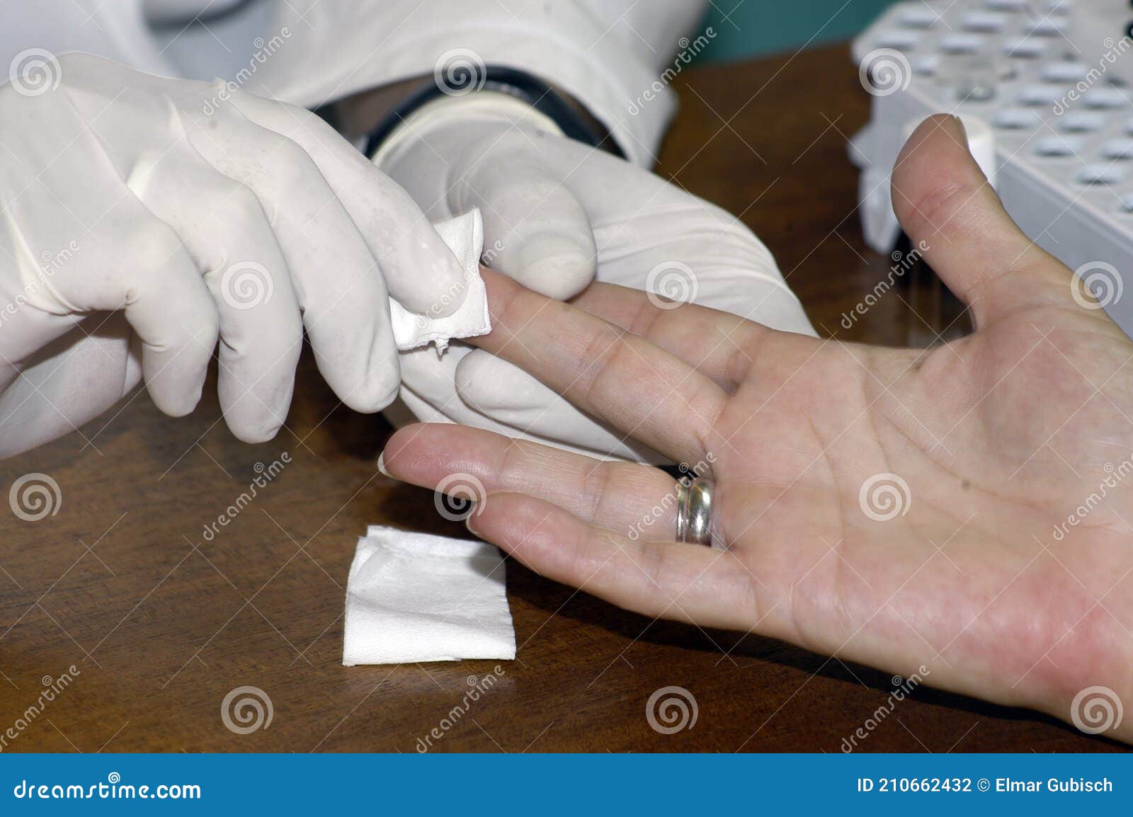 A Patient Gets Blood Tested Stock Photo - Image of lowering, practice ...