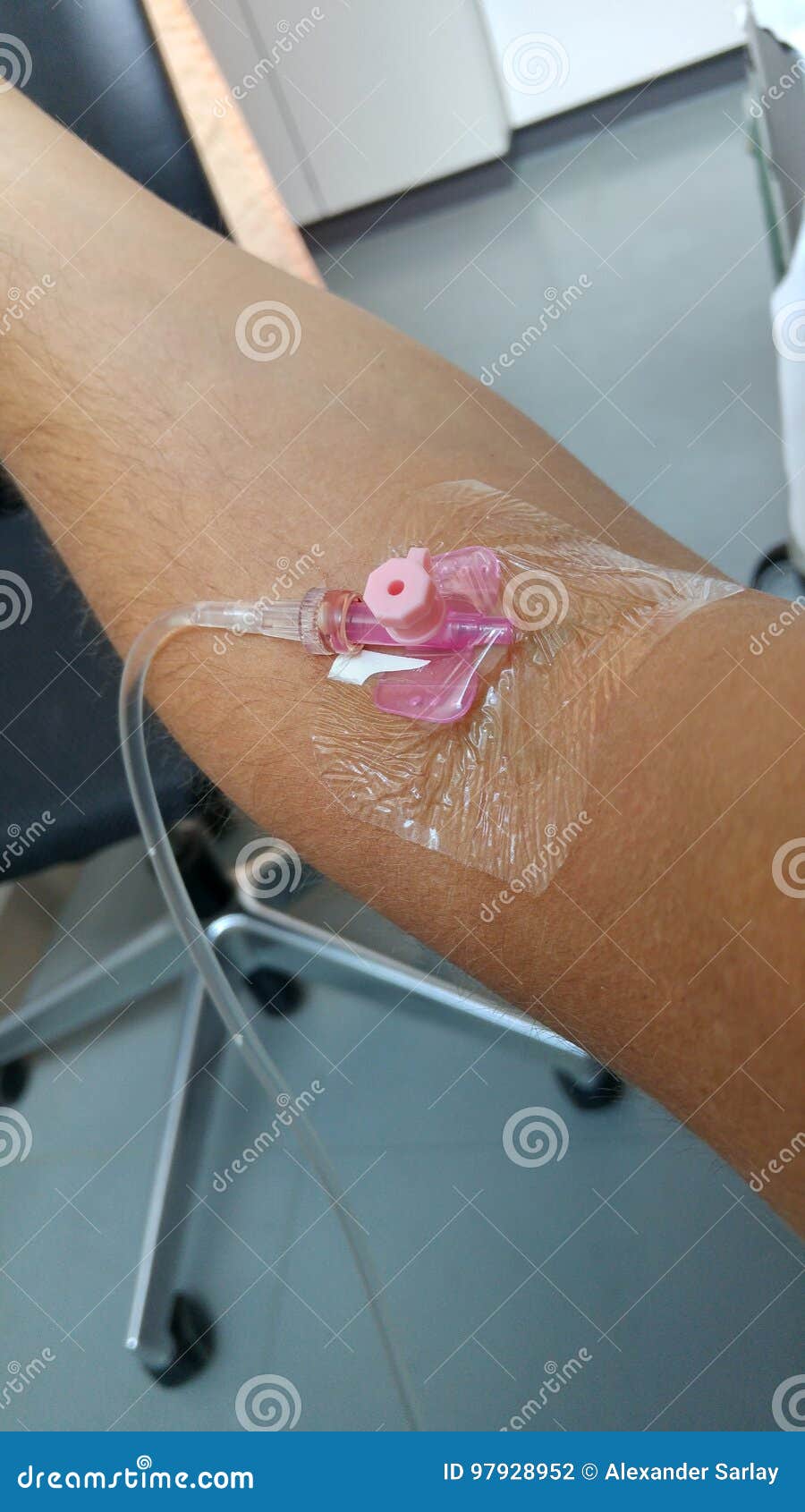 Patient Gets Infusion in His Arm Stock Photo - Image of infusion, hose ...
