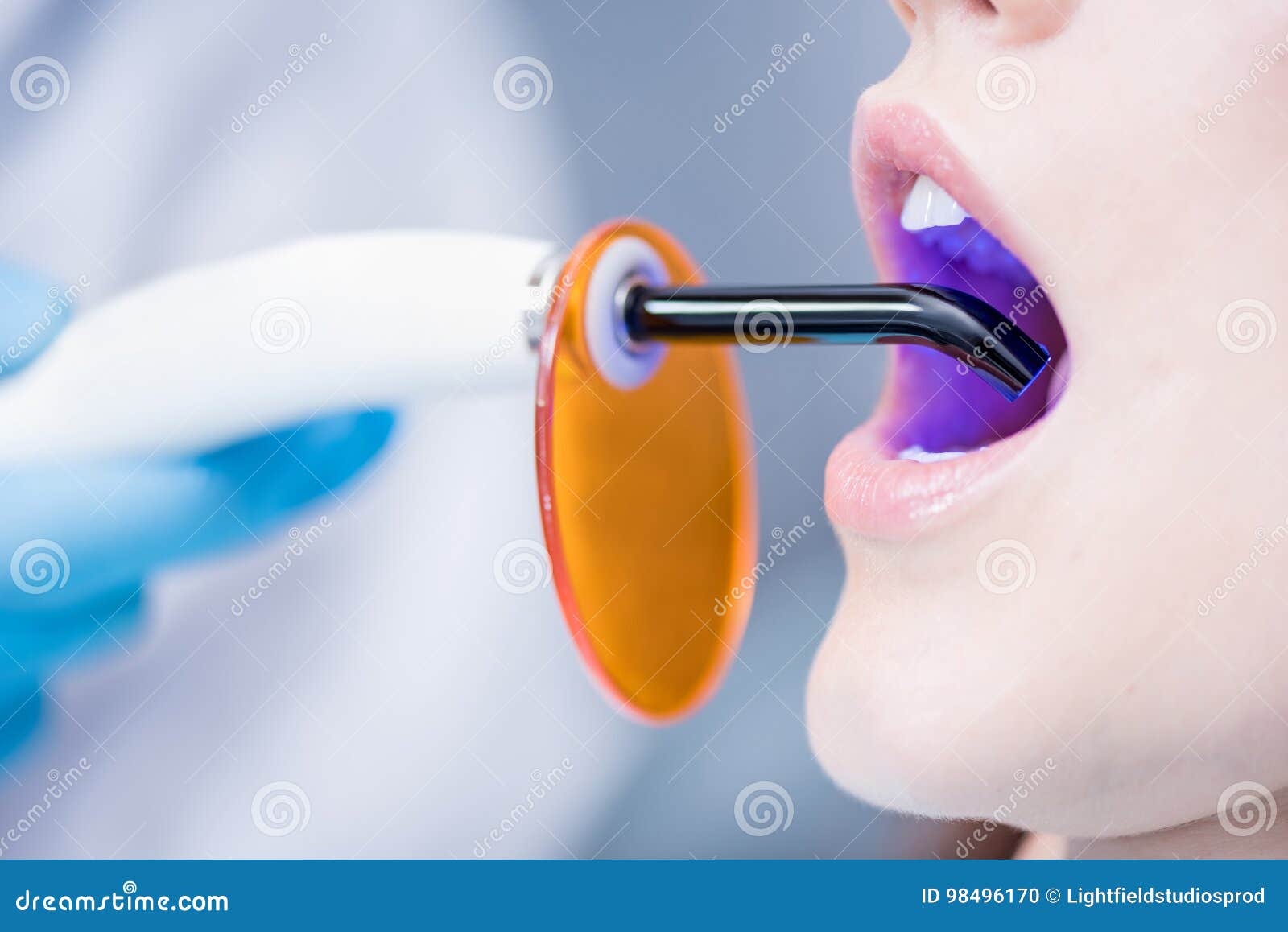 Patient Getting Teeth Cured with Dental Curing Light Stock Photo ...